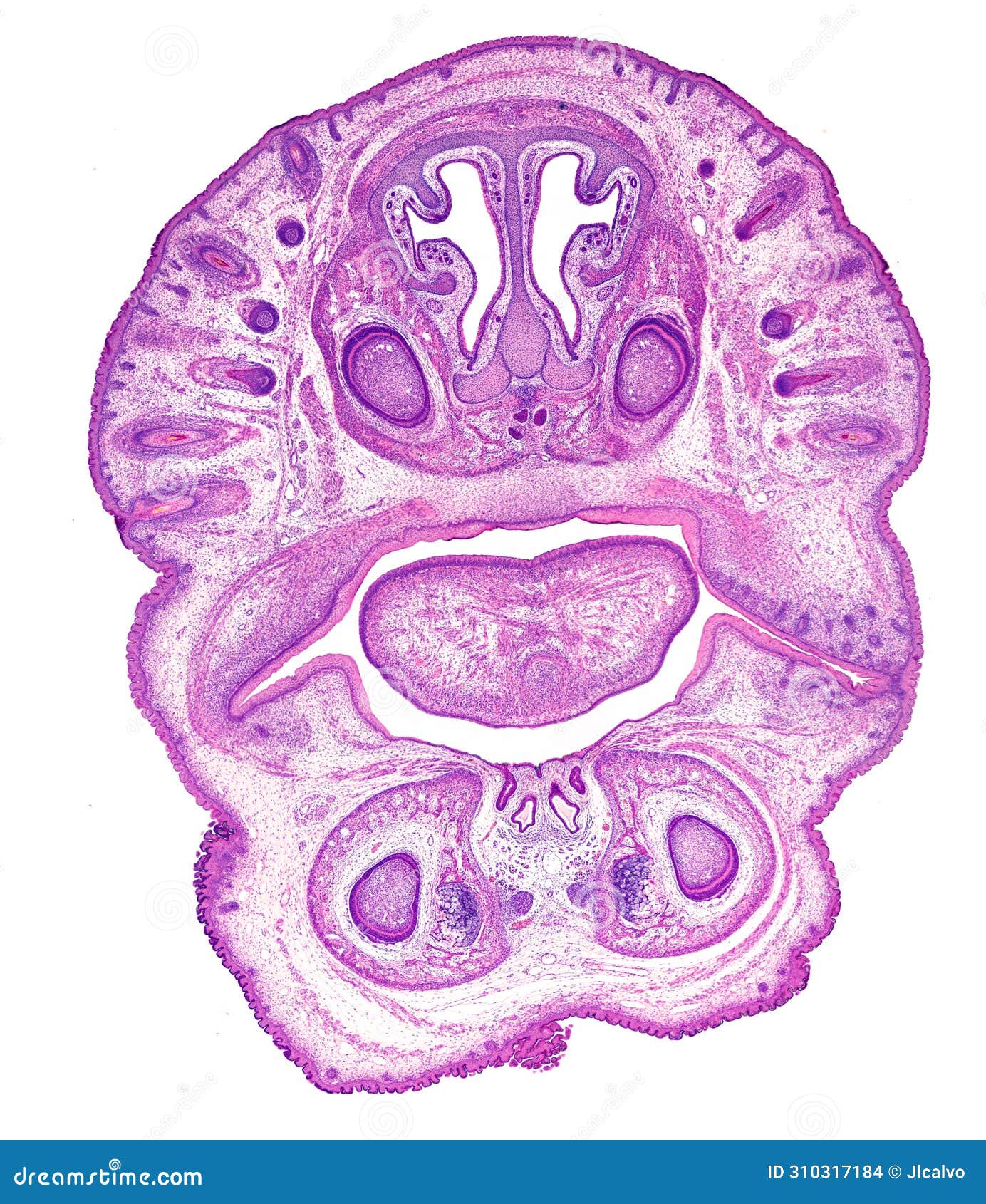 Frontal Section of Embryo S Head Stock Photo - Image of embryo, tongue ...