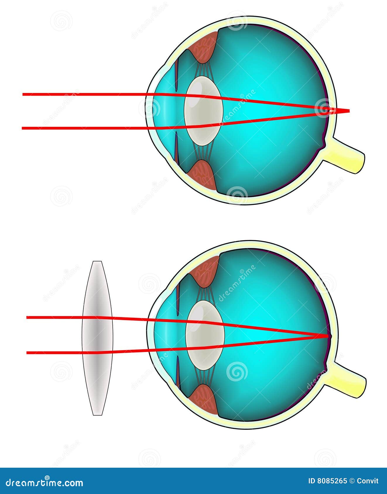 Verziend Menselijk Oogdiagram Vector Illustratie - Illustration of ...