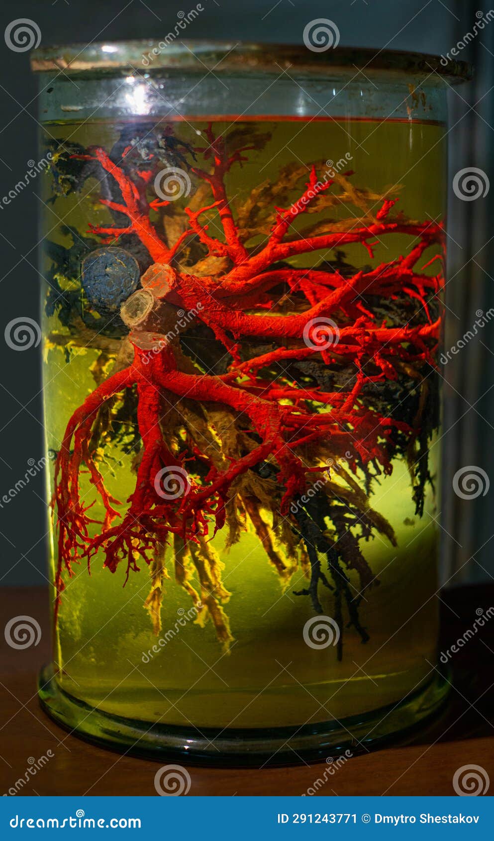 Vessels of the Human Circulatory System in Formaldehyde Solution ...