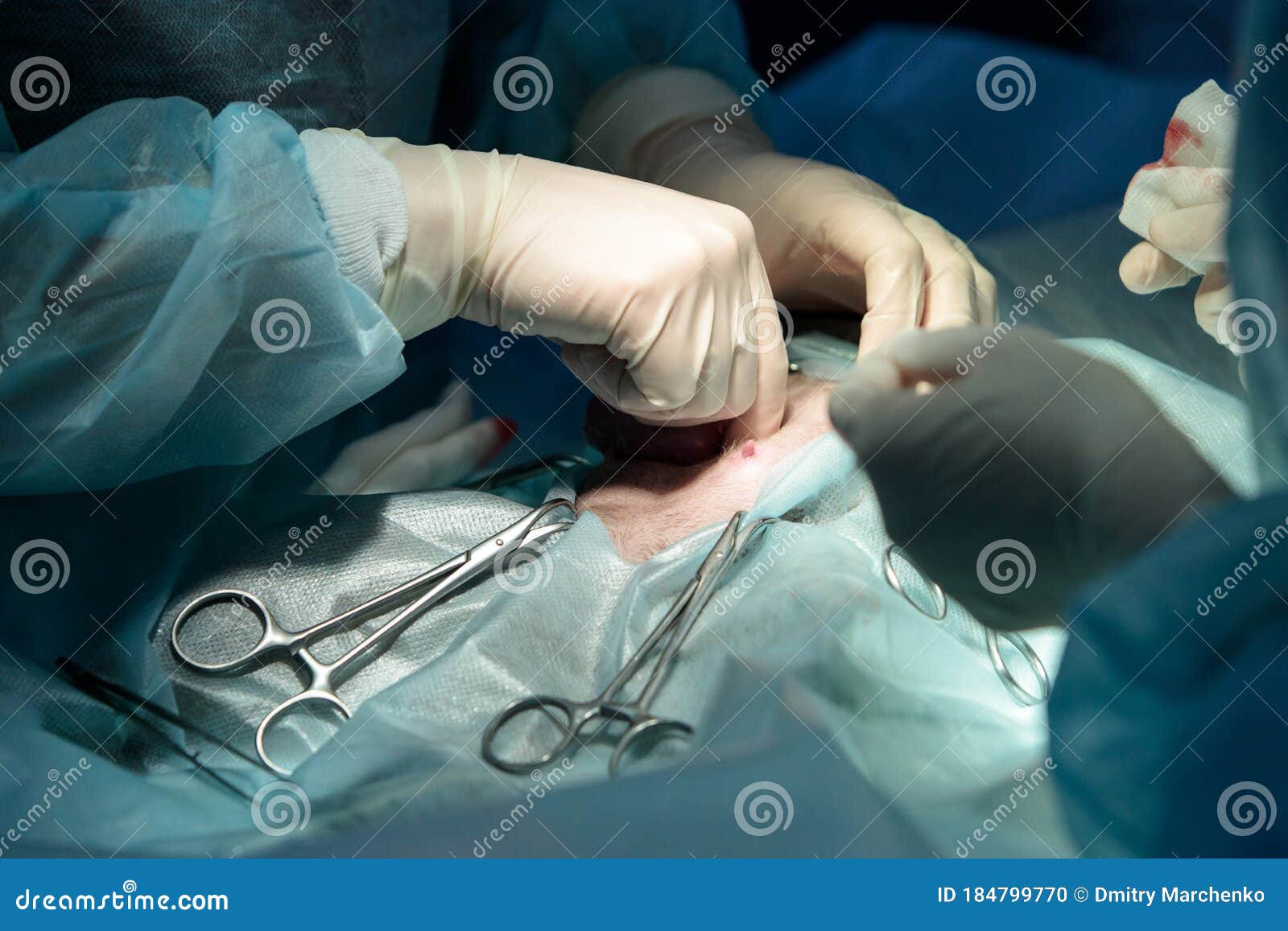Veterinary Surgery, Operation, Laparotomy. Close Up of Cesarean Section ...
