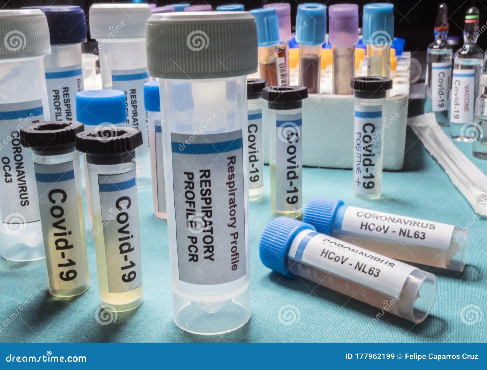 Vials Containing Samples from Patients Infected with Covid19 ...
