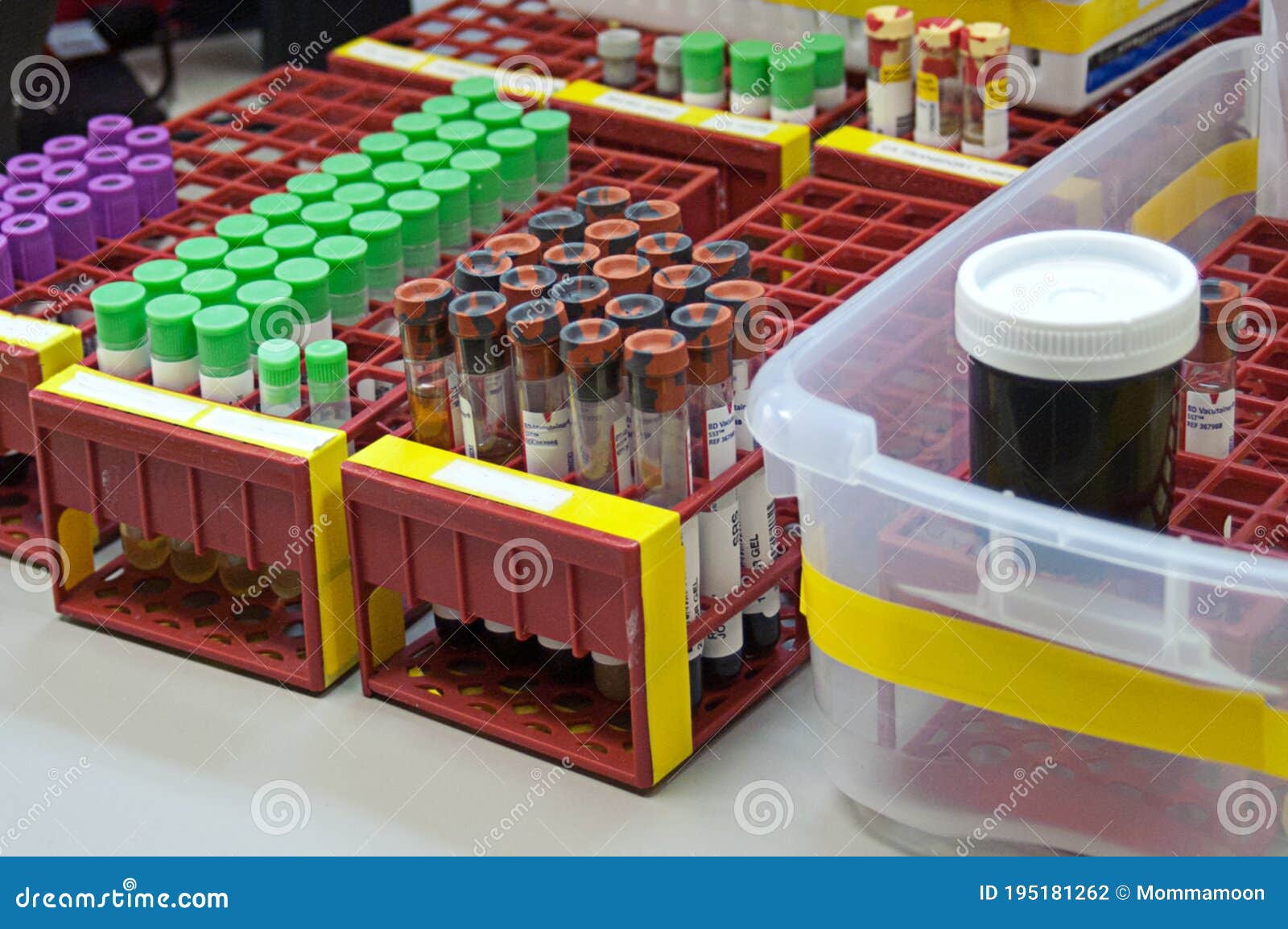 Vials Ready for Lab Testing Stock Photo - Image of respiratory, care ...