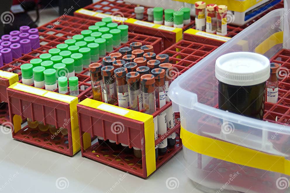 Vials Ready for Lab Testing Stock Photo - Image of respiratory, care ...