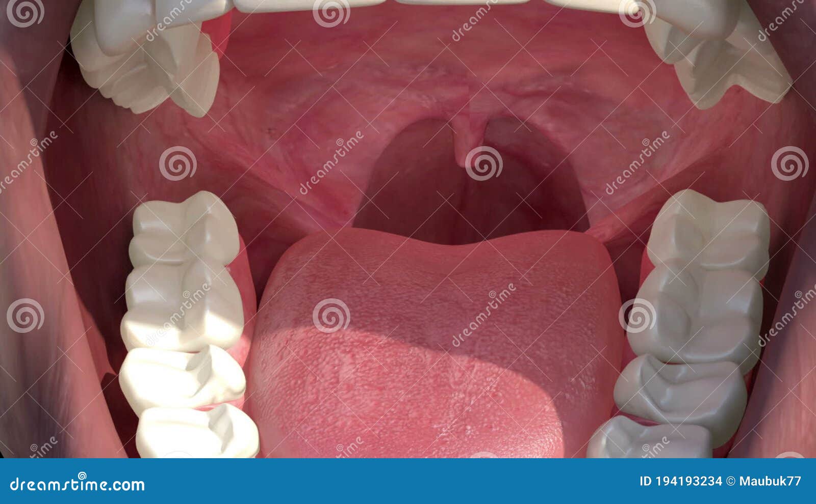 Inflammation of the Tonsils with White Spots Stains Stock Footage ...