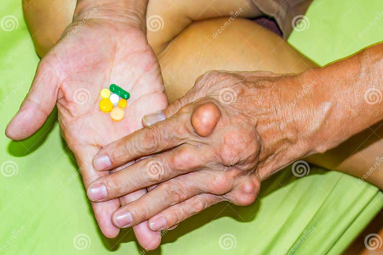 Vieillesse Et Maladies Du Médicament Pharmaceutique Goutte Sévère Chez ... Vieillesse Et Maladies Du Médicament Pharmaceutique Goutte Sévère Chez ...