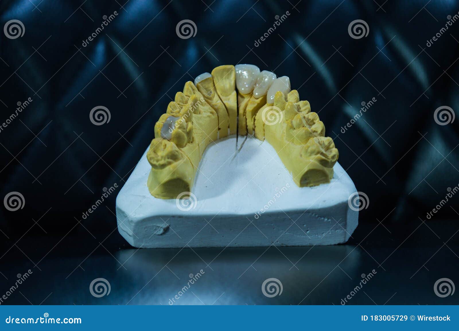 View of an Artificial Jaw Showing the Teeth on a Stand with a Dark ...
