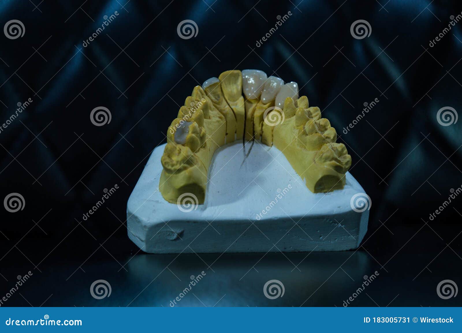 View of an Artificial Jaw Showing the Teeth on a Stand with a Dark ...