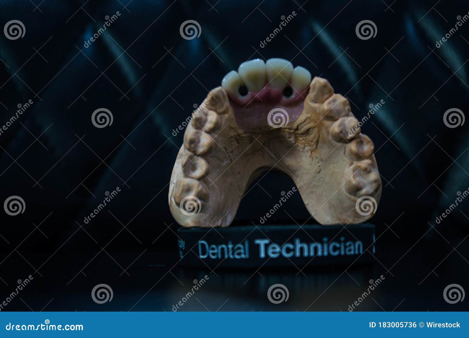View of an Artificial Jaw Showing the Teeth on a Stand with a Dark ...