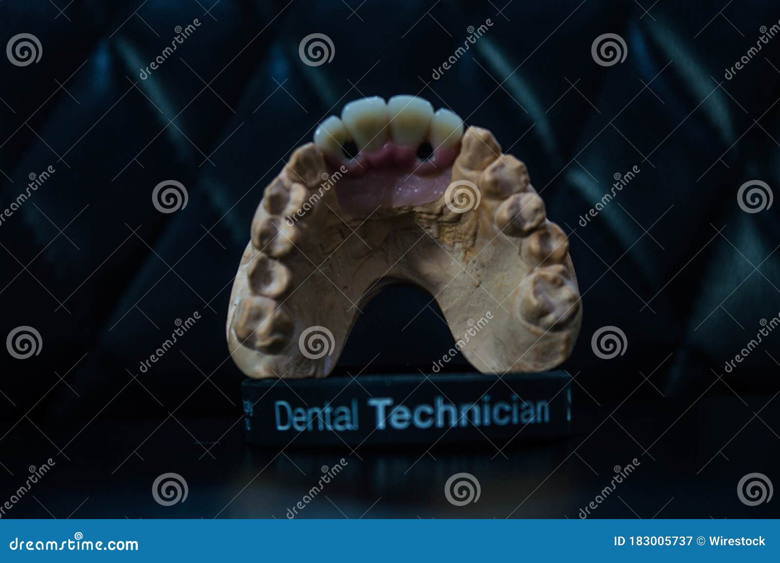View of an Artificial Jaw Showing the Teeth on a Stand with a Dark ...