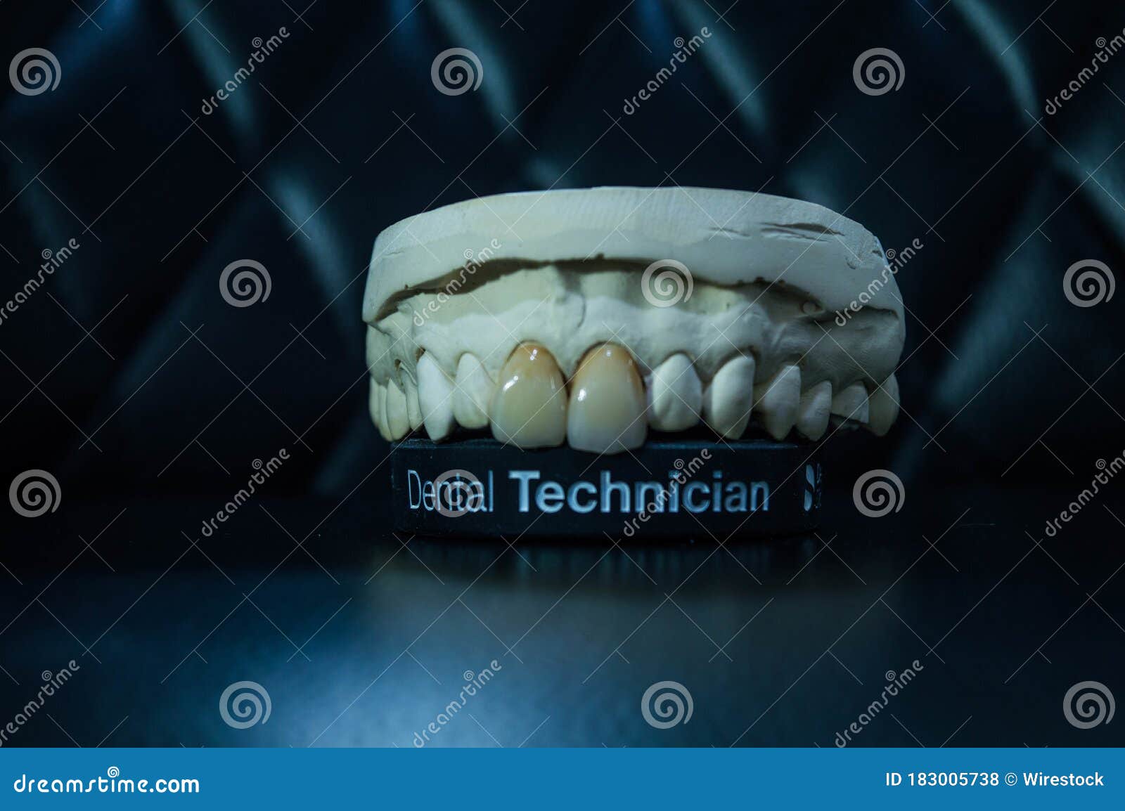 View of an Artificial Jaw Showing the Teeth on a Stand with a Dark ...
