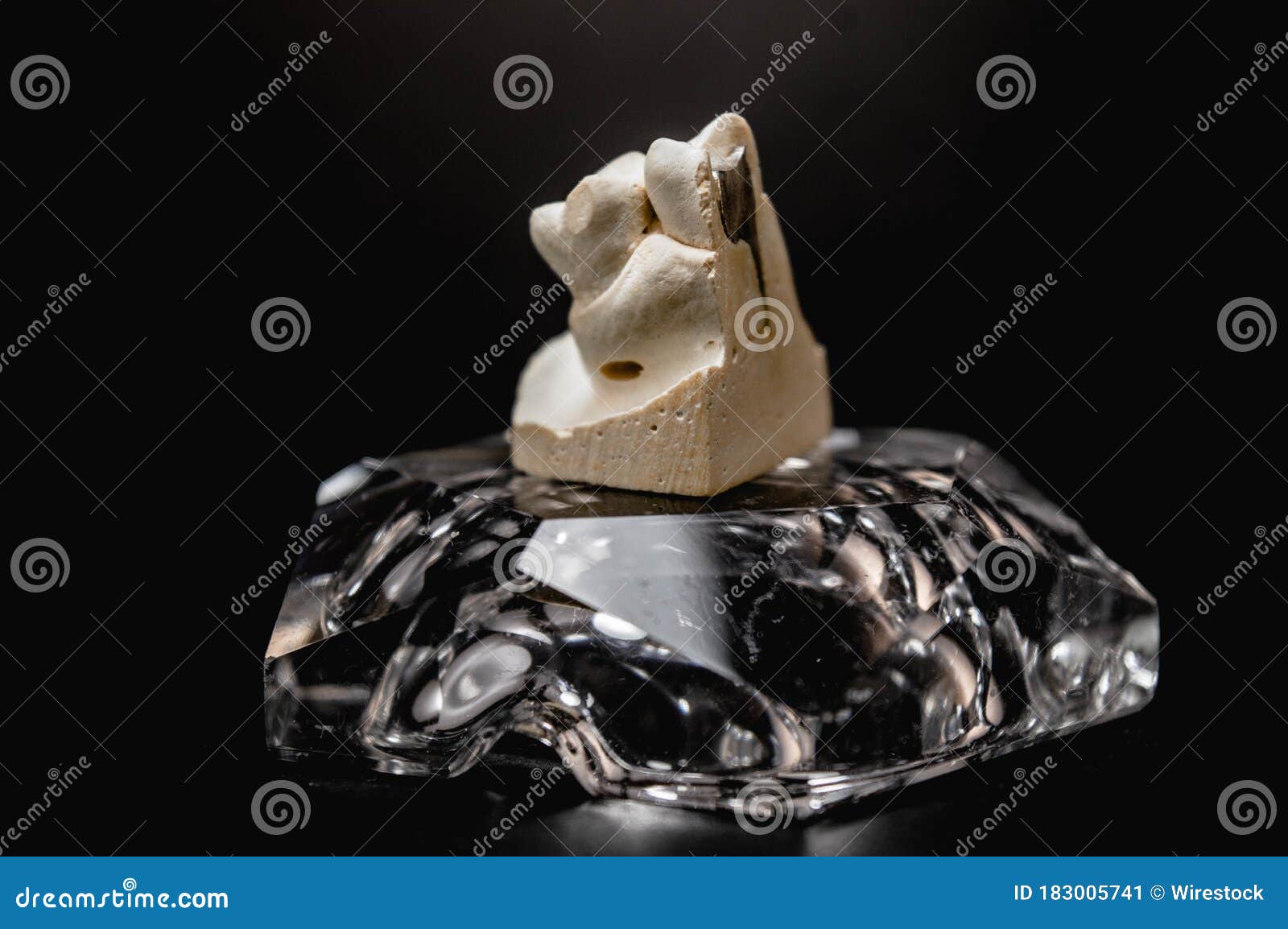View of an Artificial Jaw Showing the Teeth on a Stand with a Dark ...