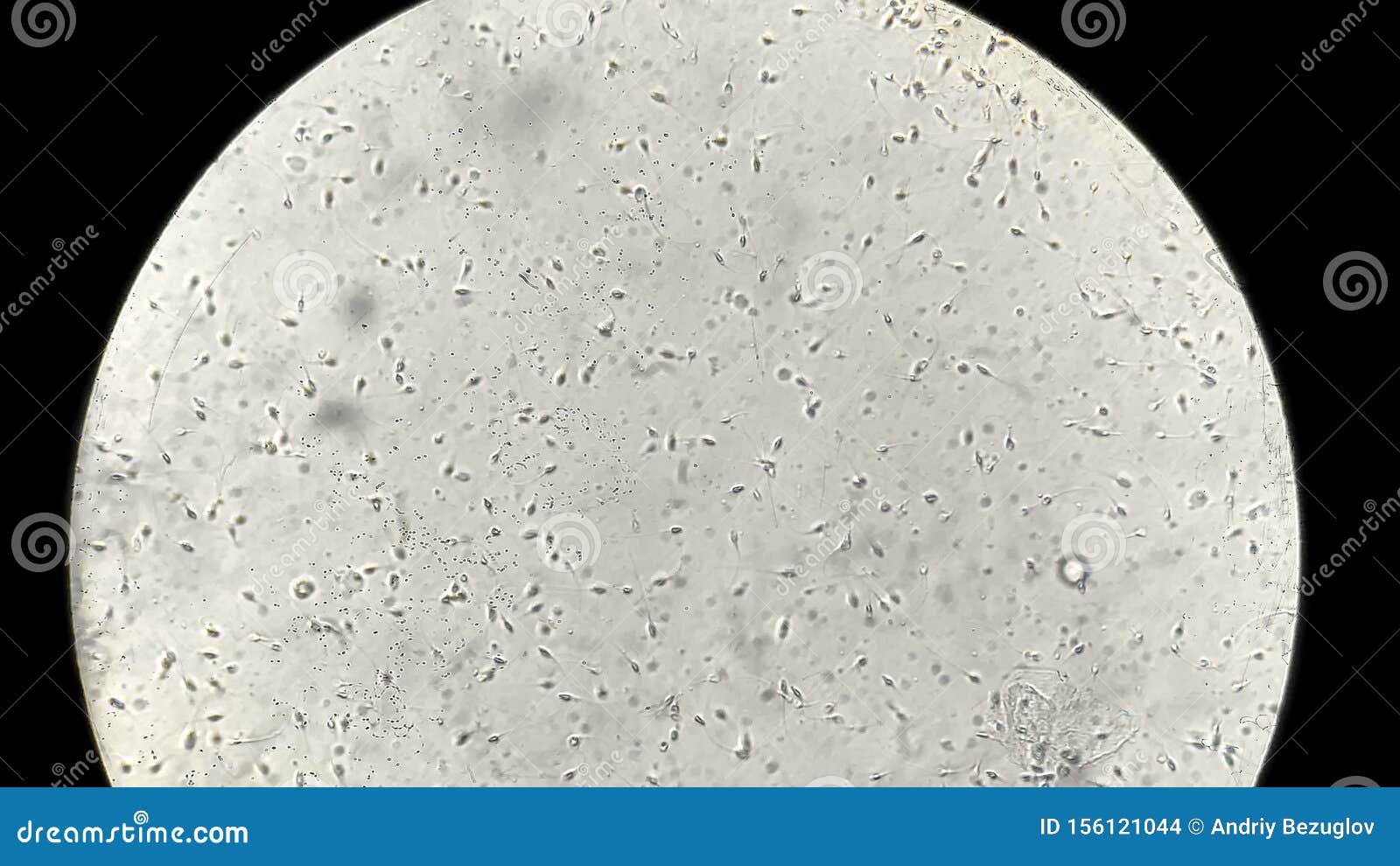 View at Human Sperm Under Microscope in Lab Stock Footage - Video of ...