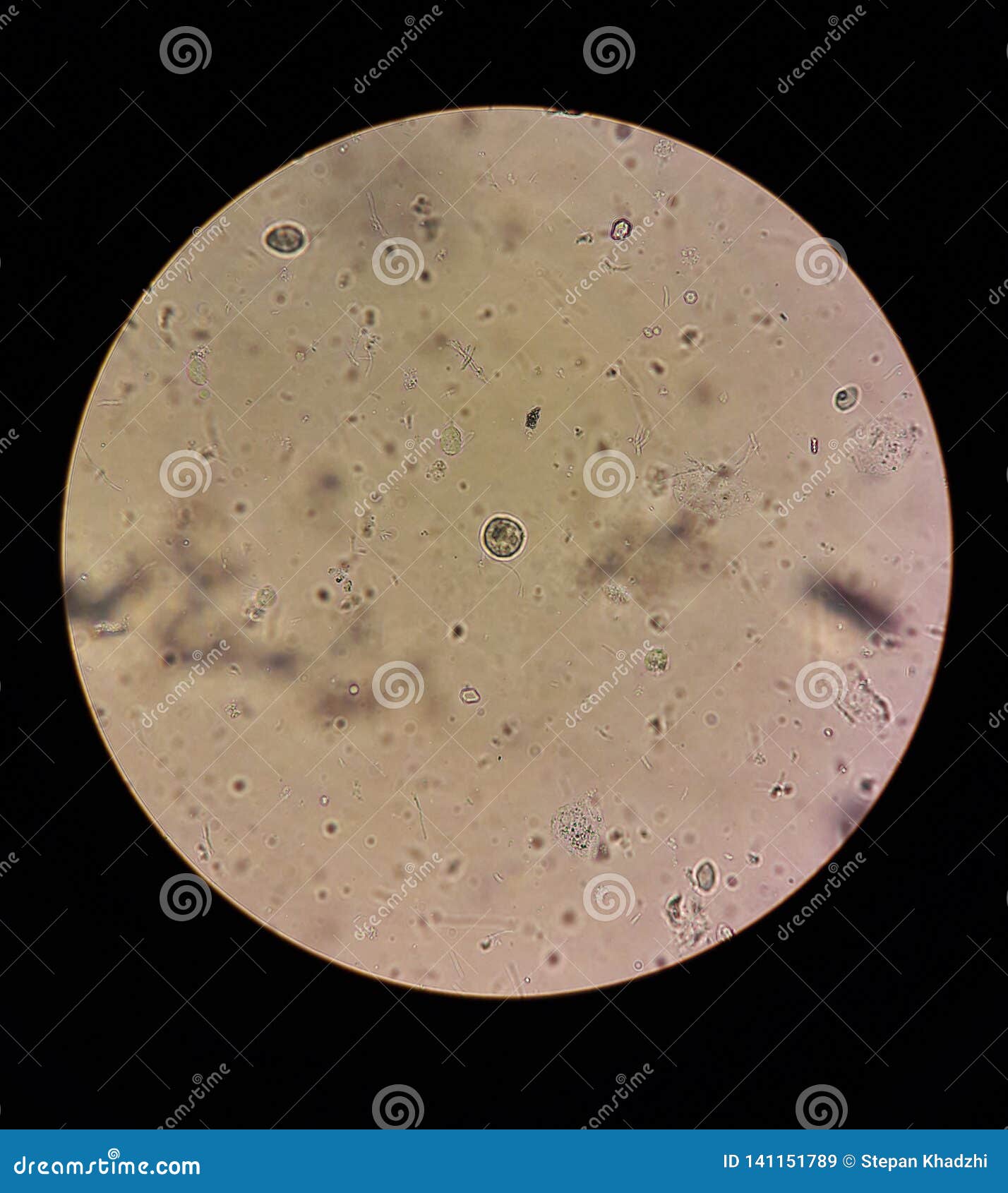 View in the Microscope on Trichomonas STD Stock Image - Image of ...