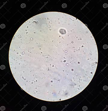 View in the Microscope on Trichomonas STD Stock Image - Image of ...