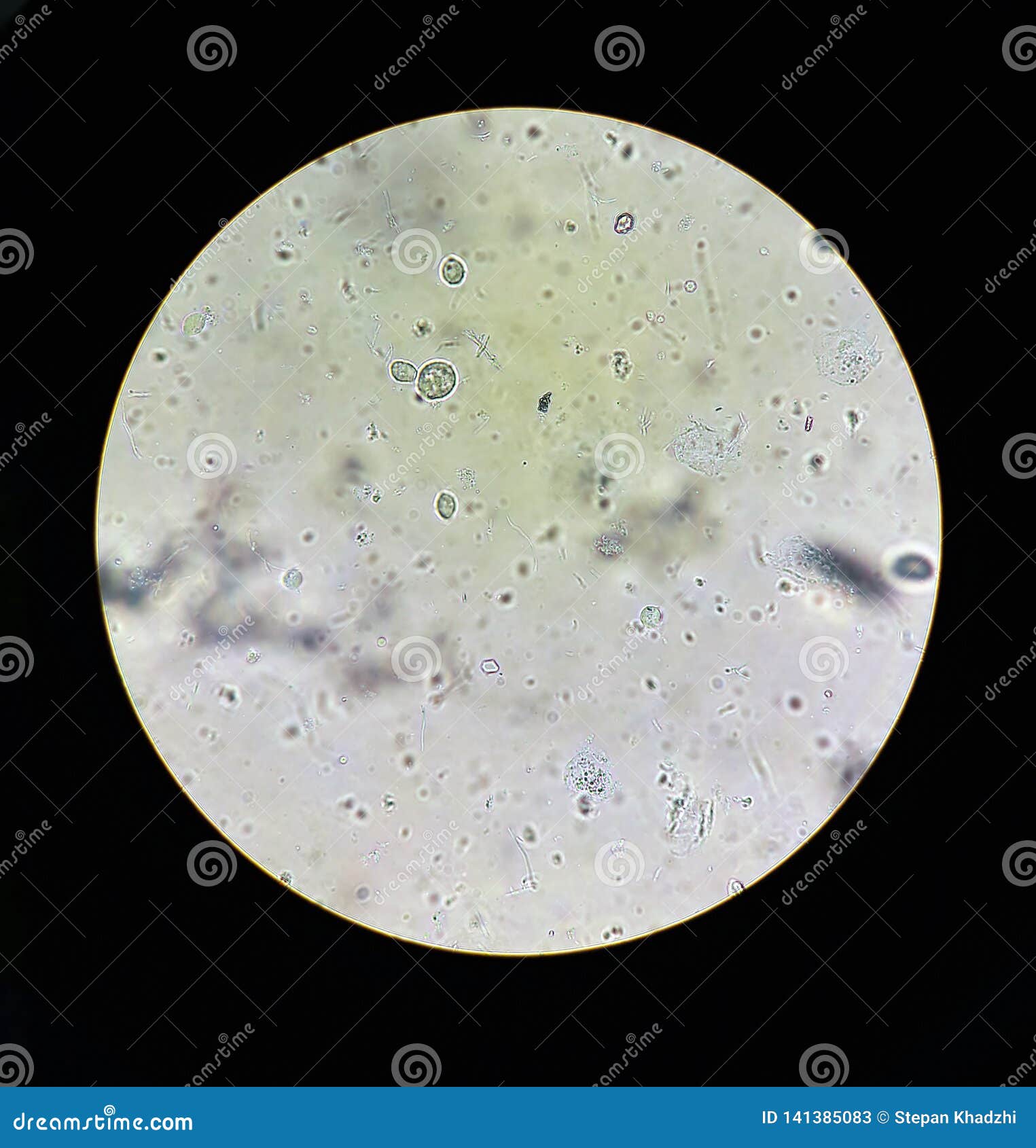 Trichomonas Microscopic View Sexually Transmitted Disease STD Royalty ...