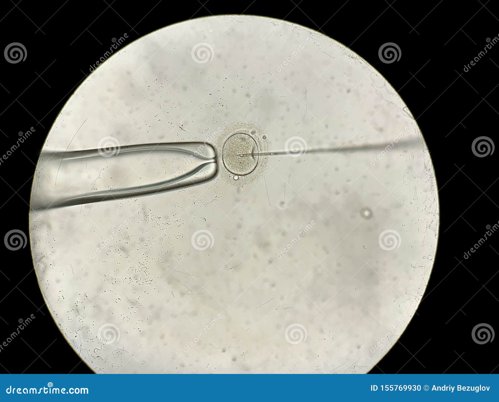 View Through Microscope At In Vitro Fertilization Process Stock Photo ...