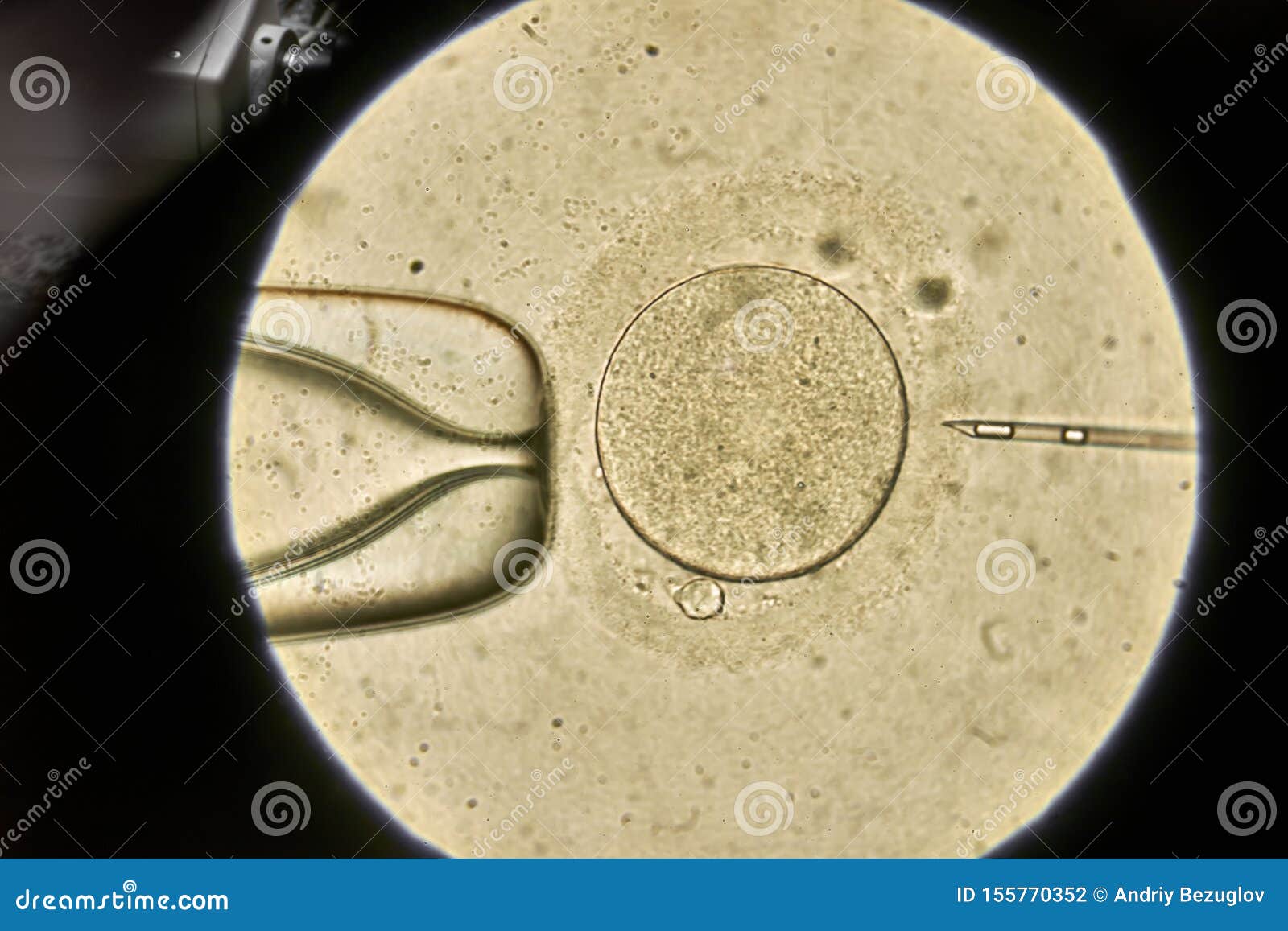 View through Microscope at in Vitro Fertilization Process Stock Photo ...