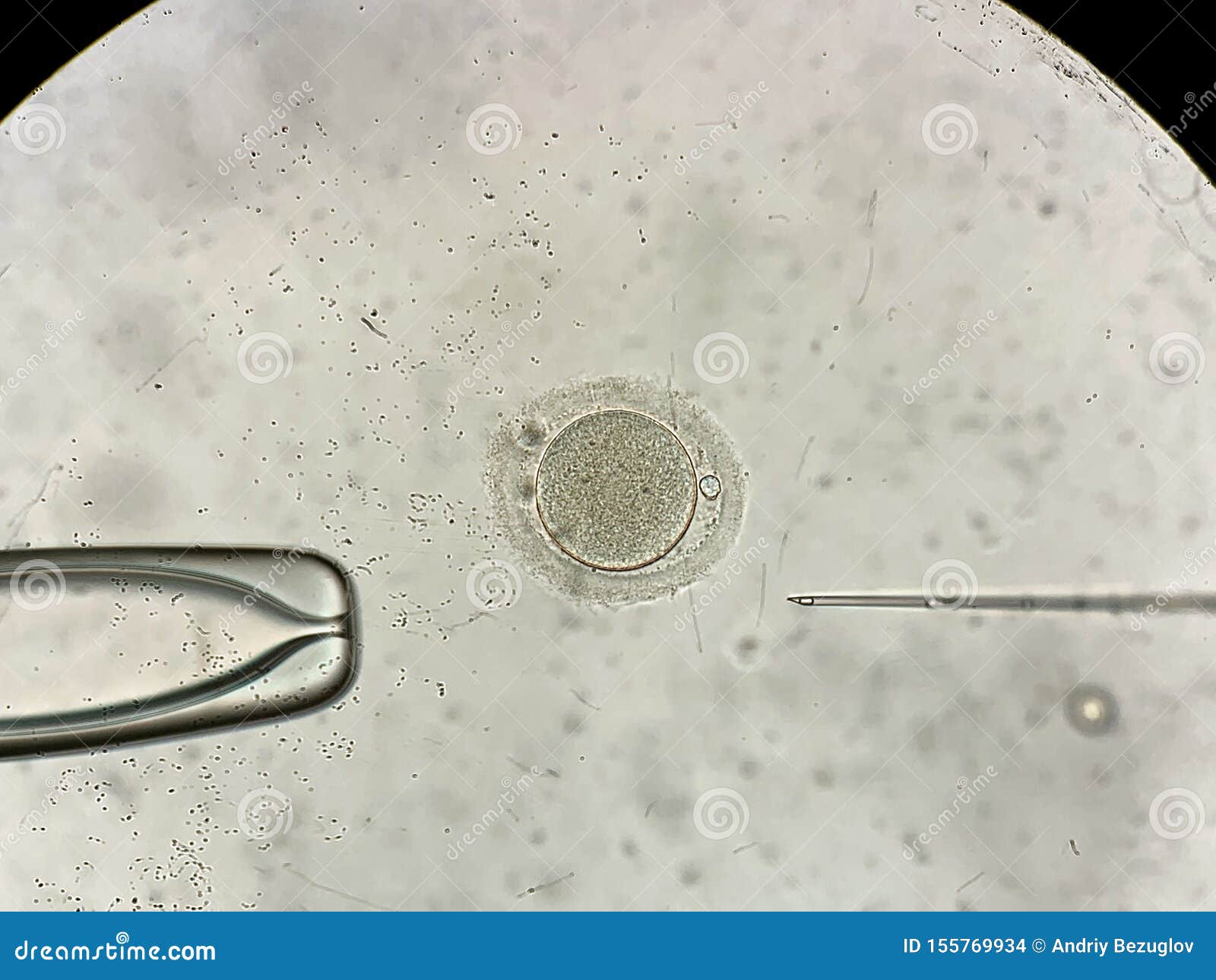 View through Microscope at in Vitro Fertilization Process Stock Photo ...