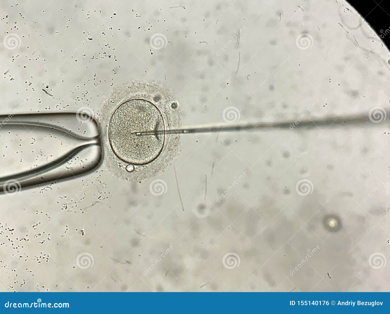 View through Microscope at in Vitro Fertilization Process Stock Photo ...