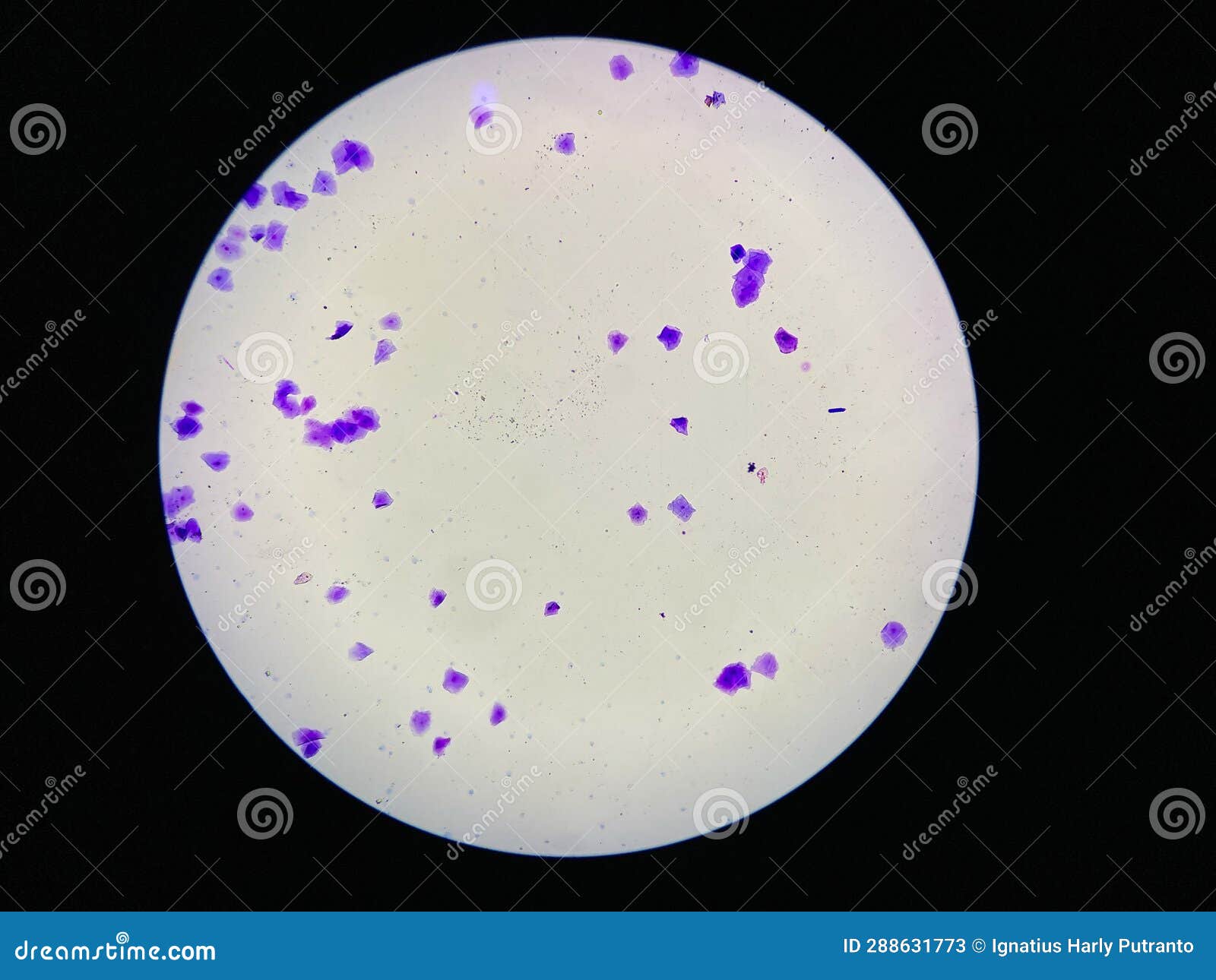 View in Microscopic of Dog Vaginal Smear Cells.Squamous Epithelium ...
