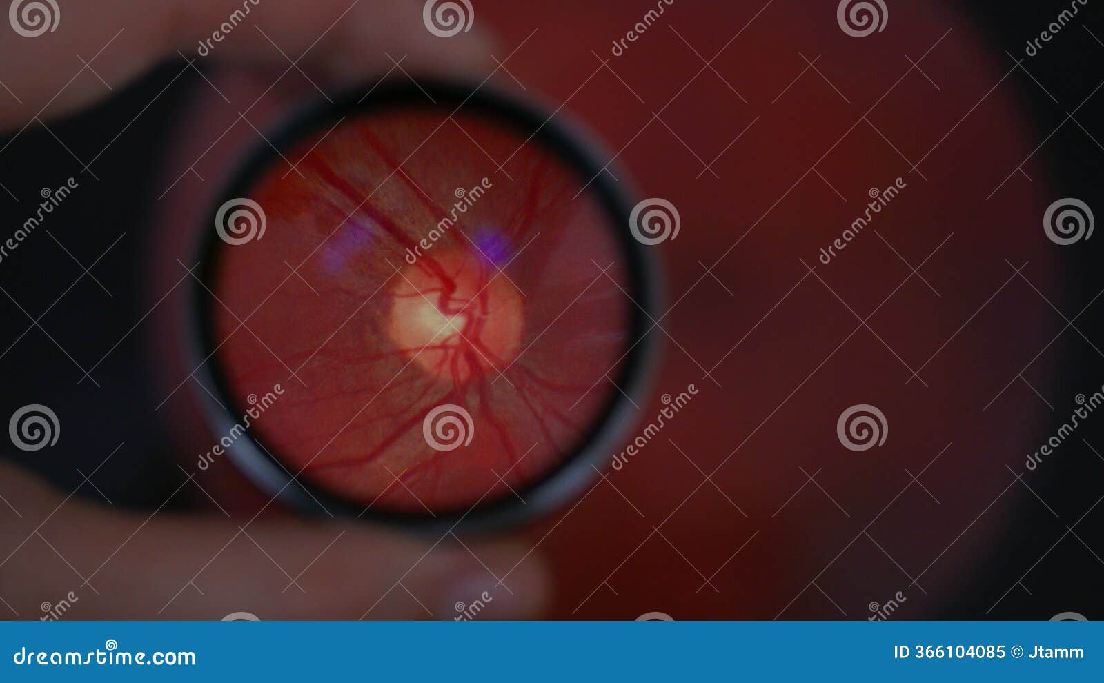 Examination Of The Fundus And Dilated Pupils. A Doctor Performs An ...