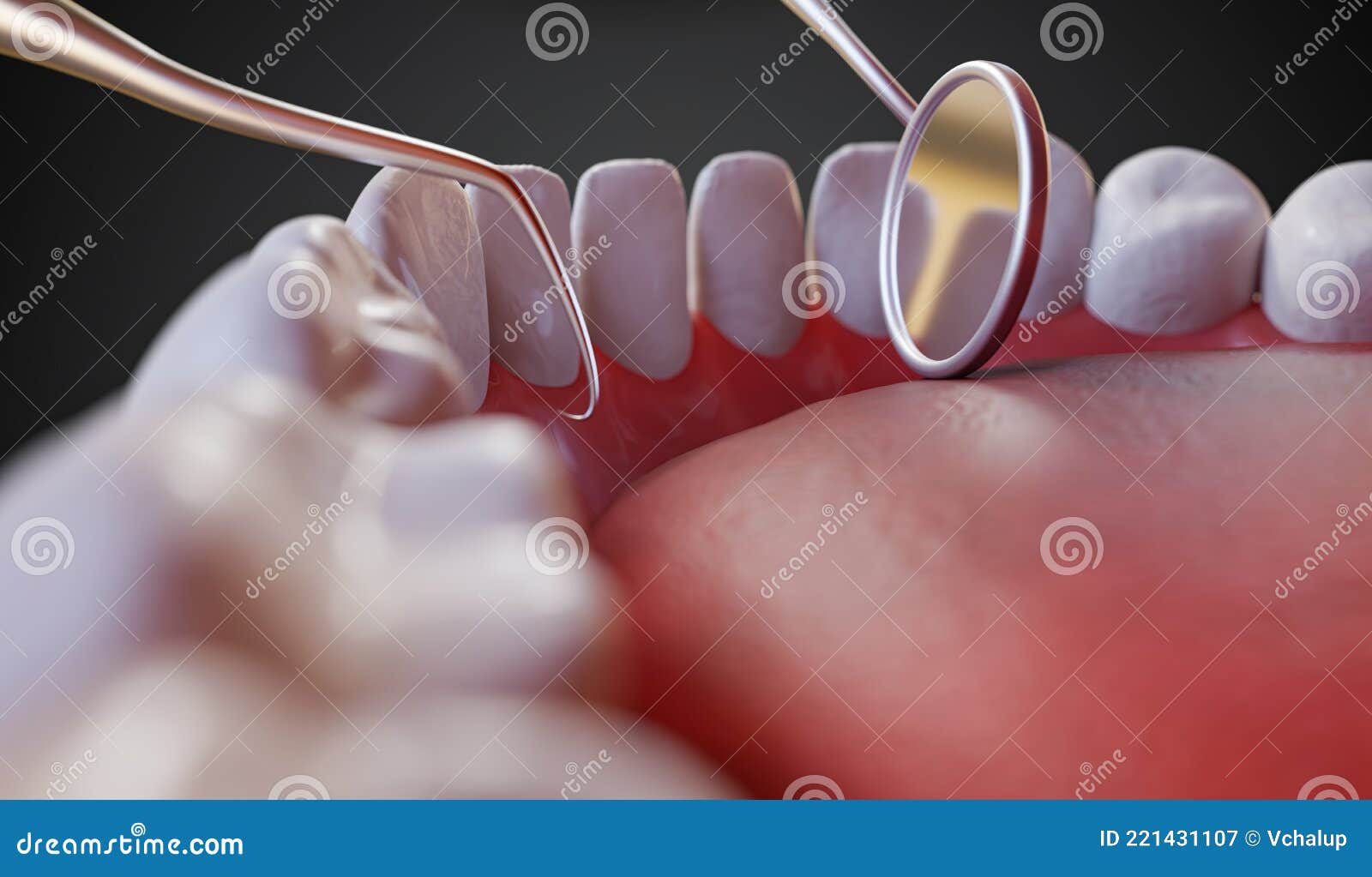 View on Teeth from Inside of Mouth during Examination at the Dentist ...