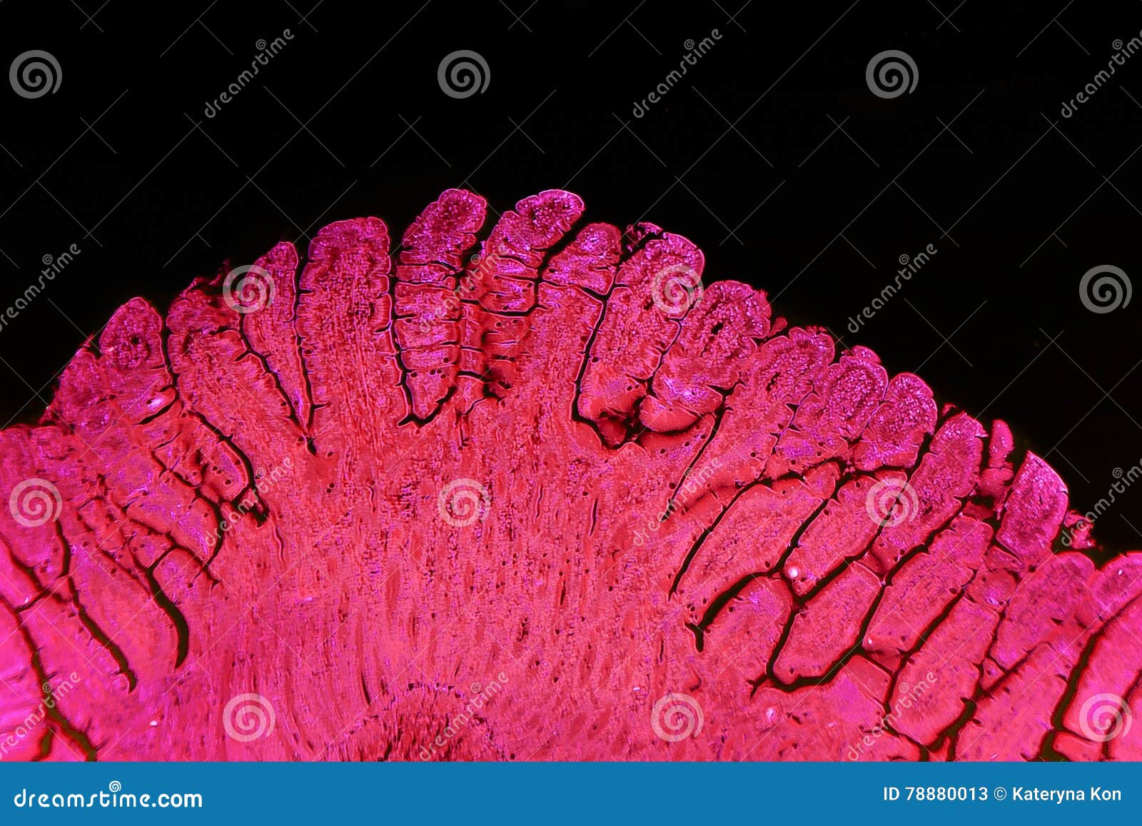 Small Intestine Villi