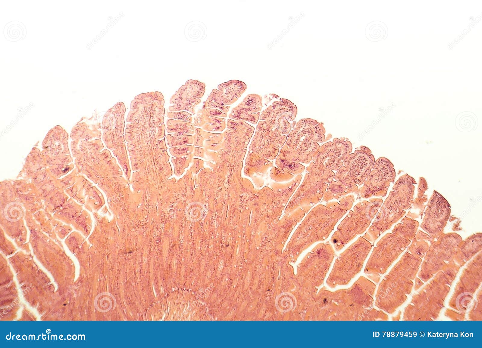 Villi of small intestine stock image. Image of light - 78879459