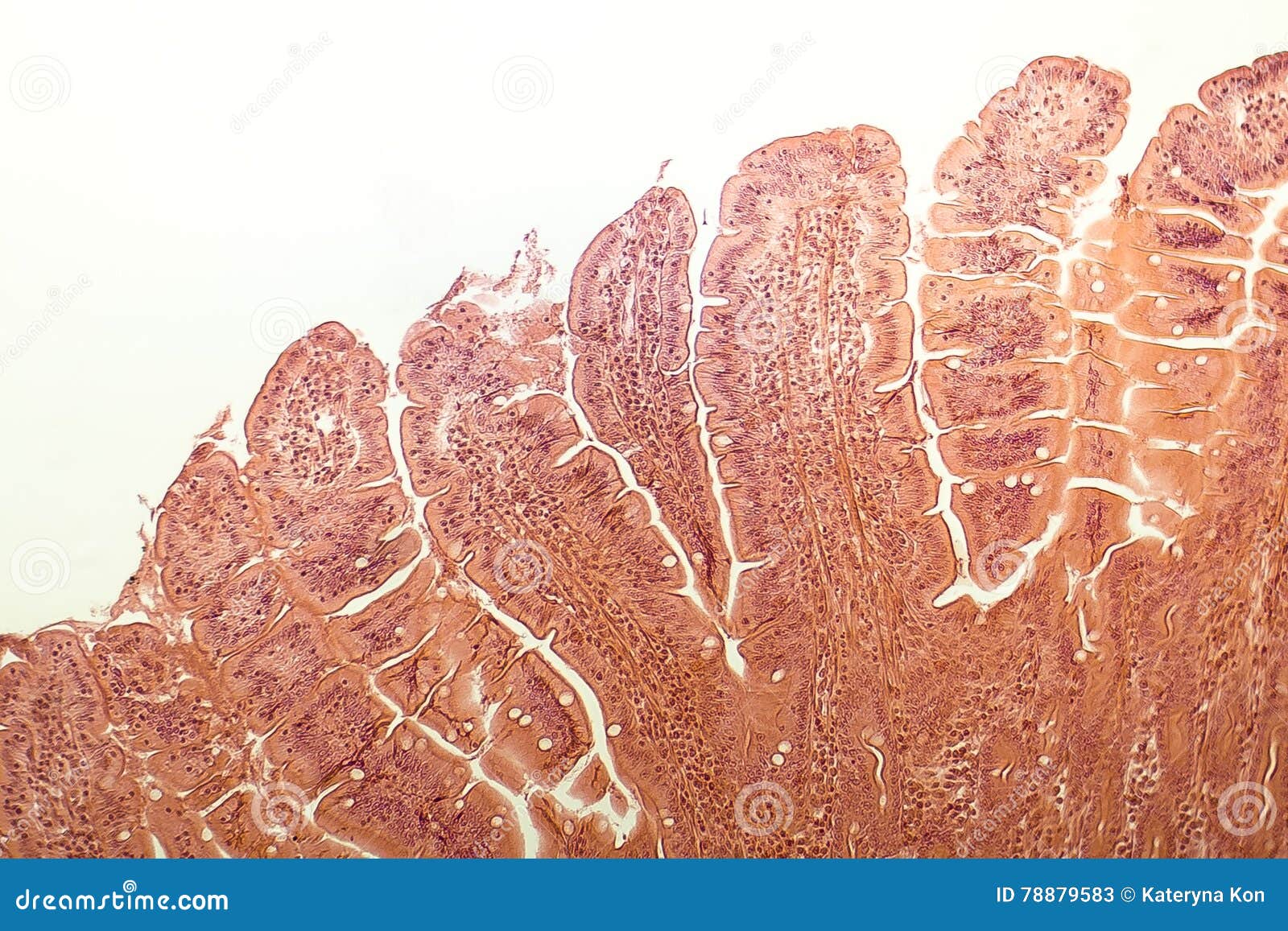 Villi of small intestine stock image. Image of microphotograph - 78879583