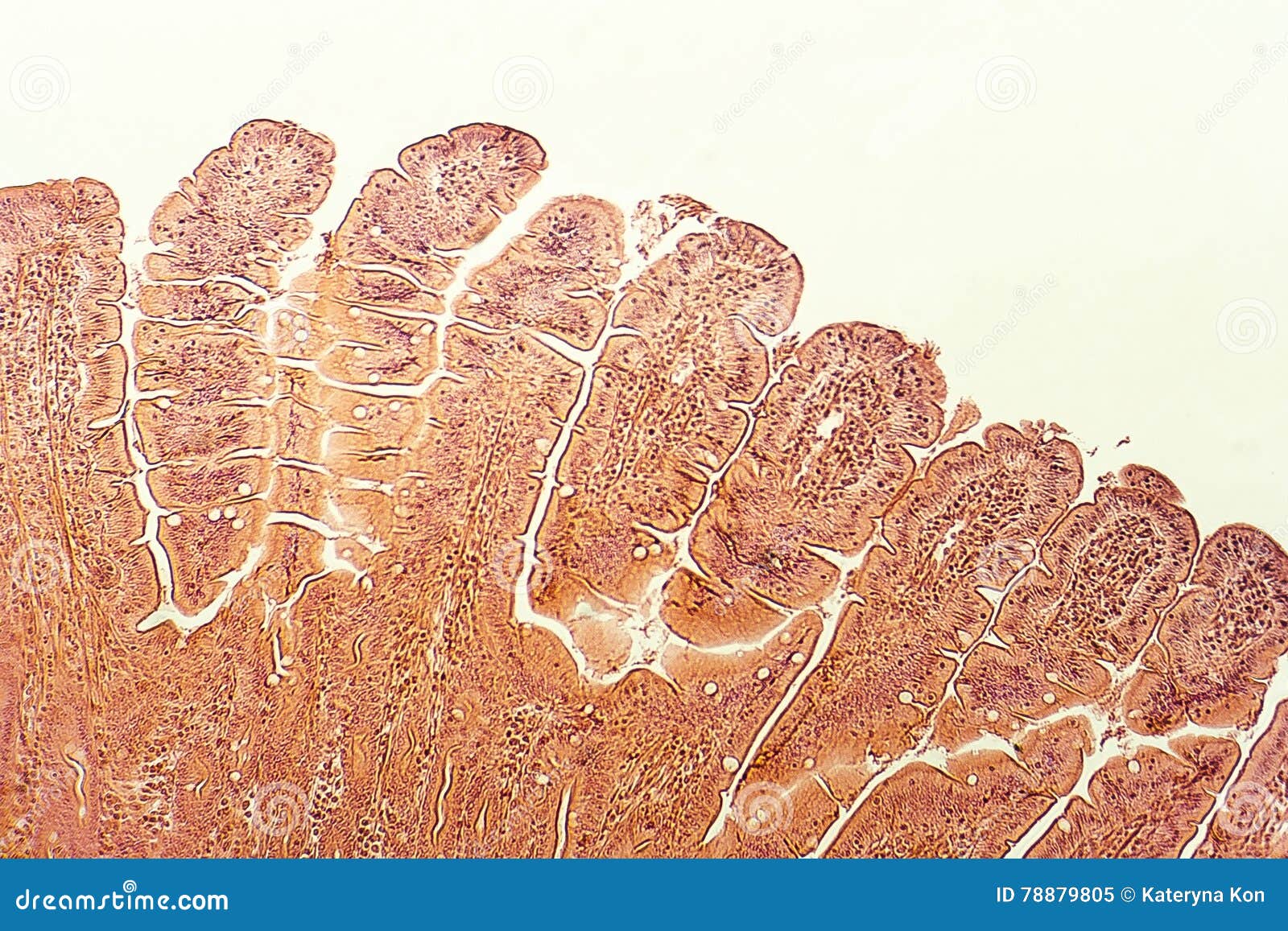 Villi of small intestine stock image. Image of education - 78879805