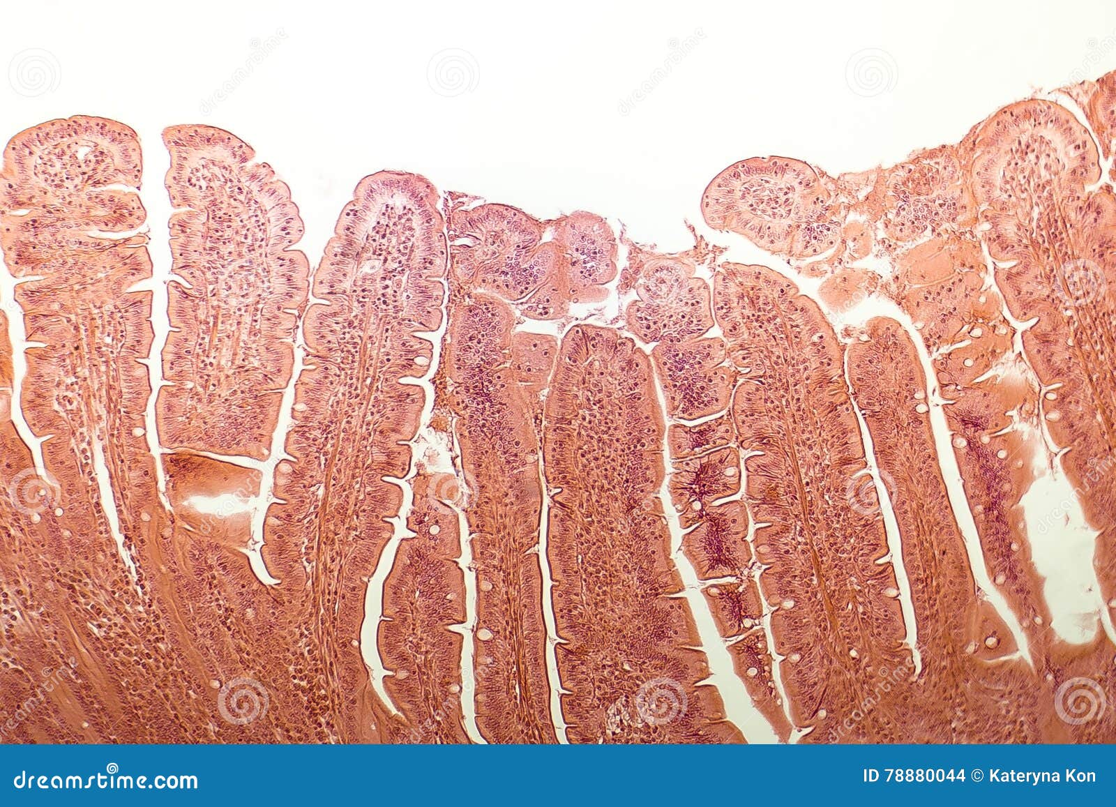 Small Intestine Royalty-Free Stock Photo | CartoonDealer.com #39027555