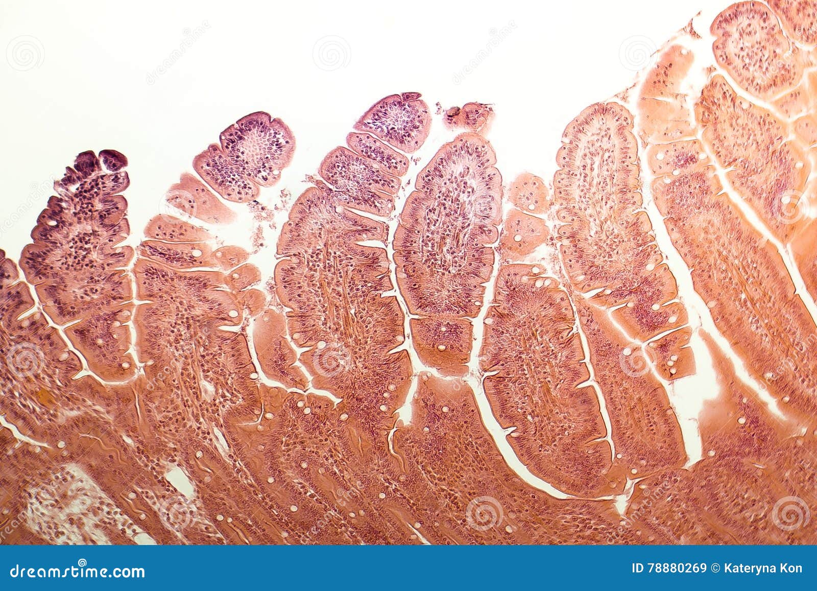 Villi Of Small Intestine, Light Micrograph Stock Image | CartoonDealer ...