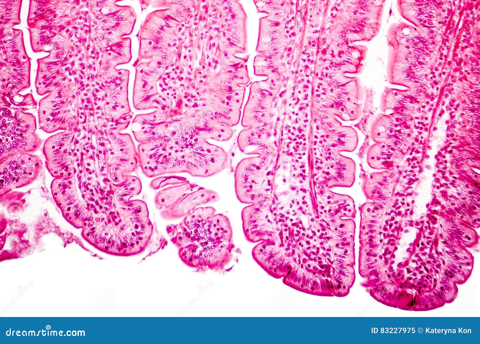 Villi of Small Intestine, Light Micrograph Stock Image - Image of ...