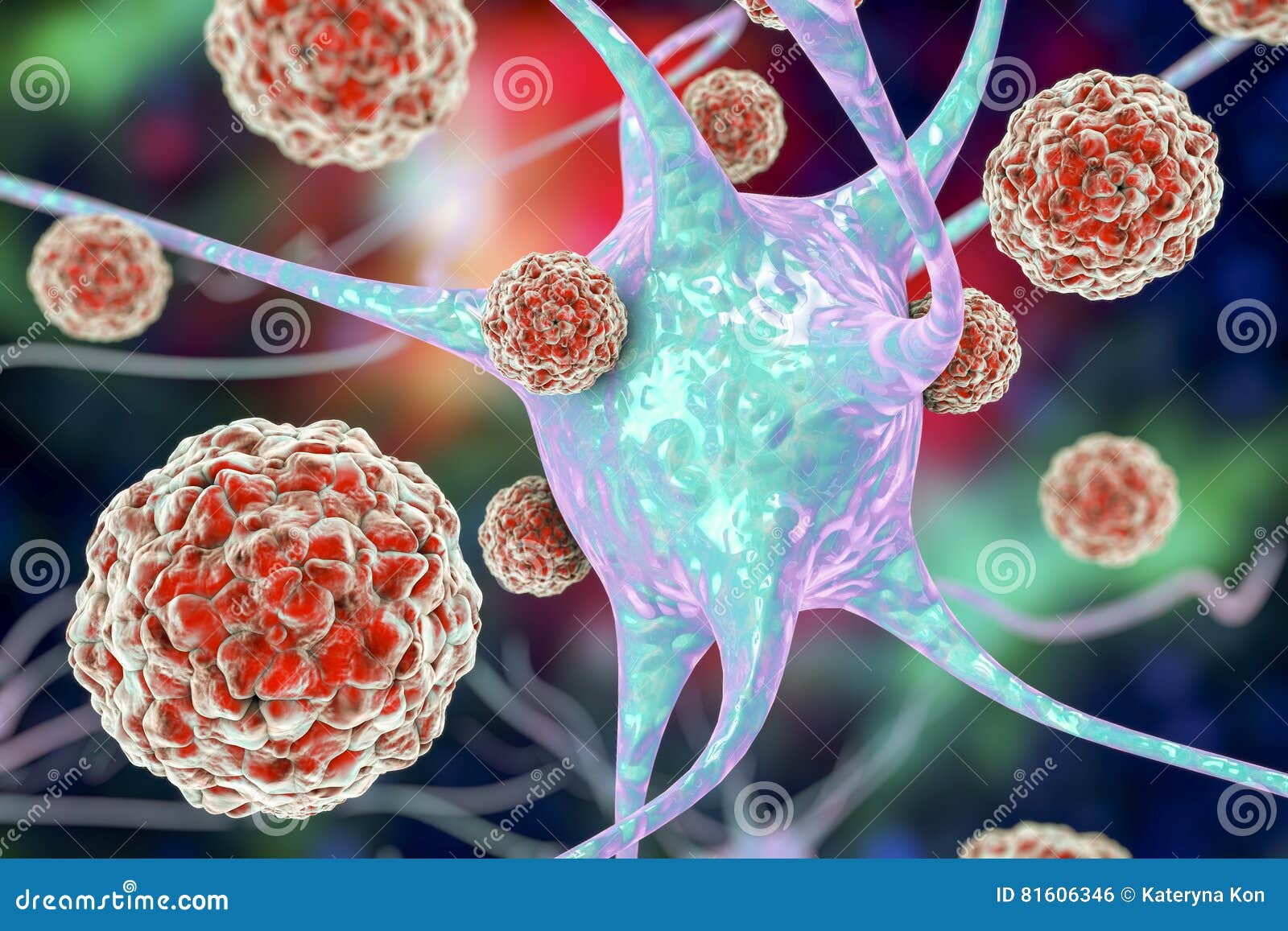 Viral infection of brain stock illustration. Illustration of ...