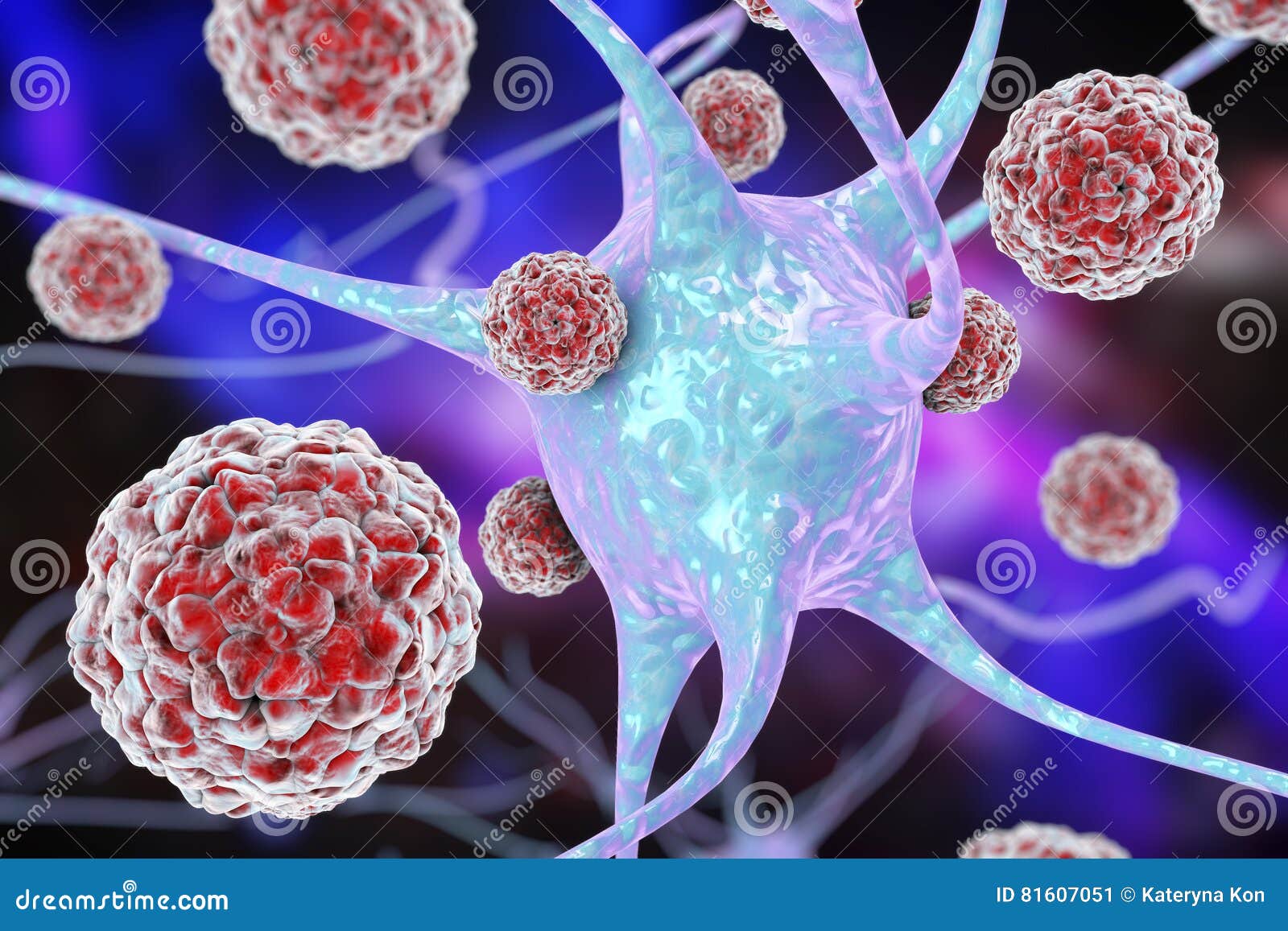 Viral infection of brain stock illustration. Illustration of health ...