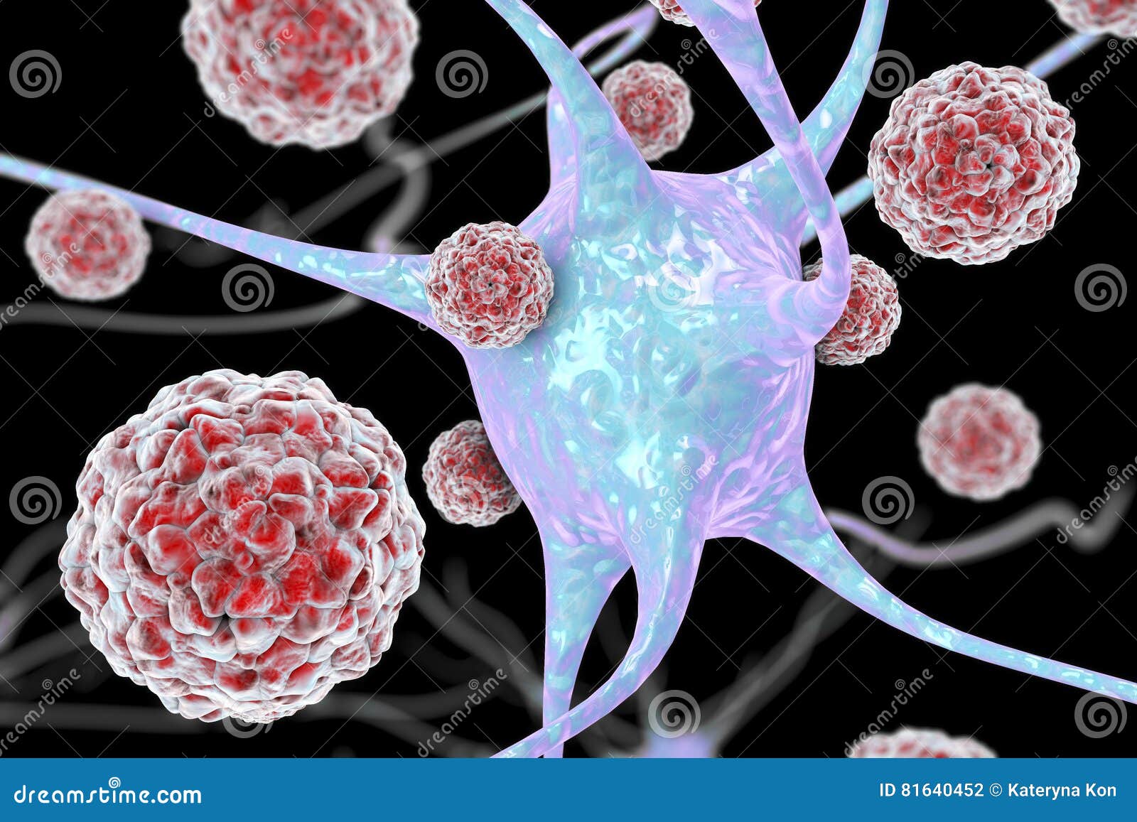 Viral infection of brain stock illustration. Illustration of closeup ...