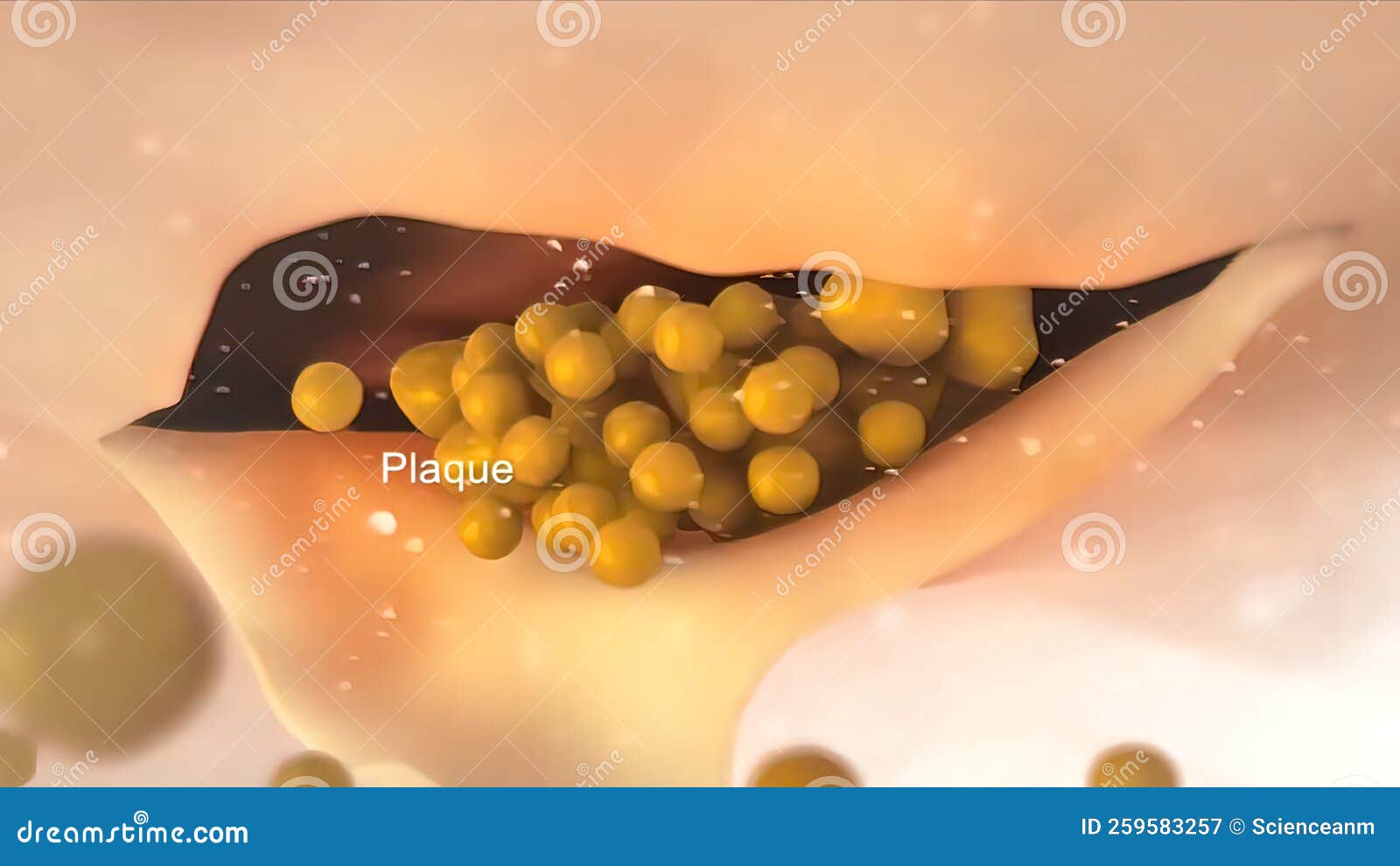 A Viral Plaque is a Visible Structure Formed within a Cell Culture ...