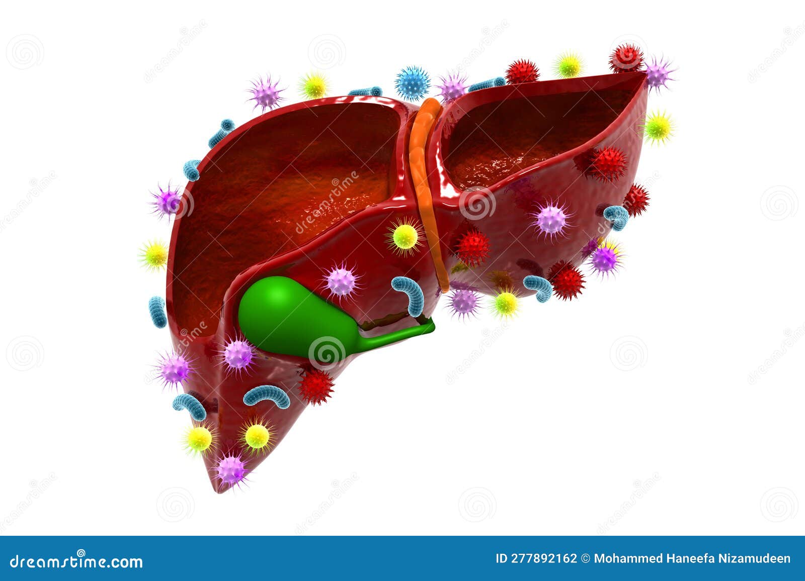 Virus and Bacteria Infected Human Liver Stock Illustration ...