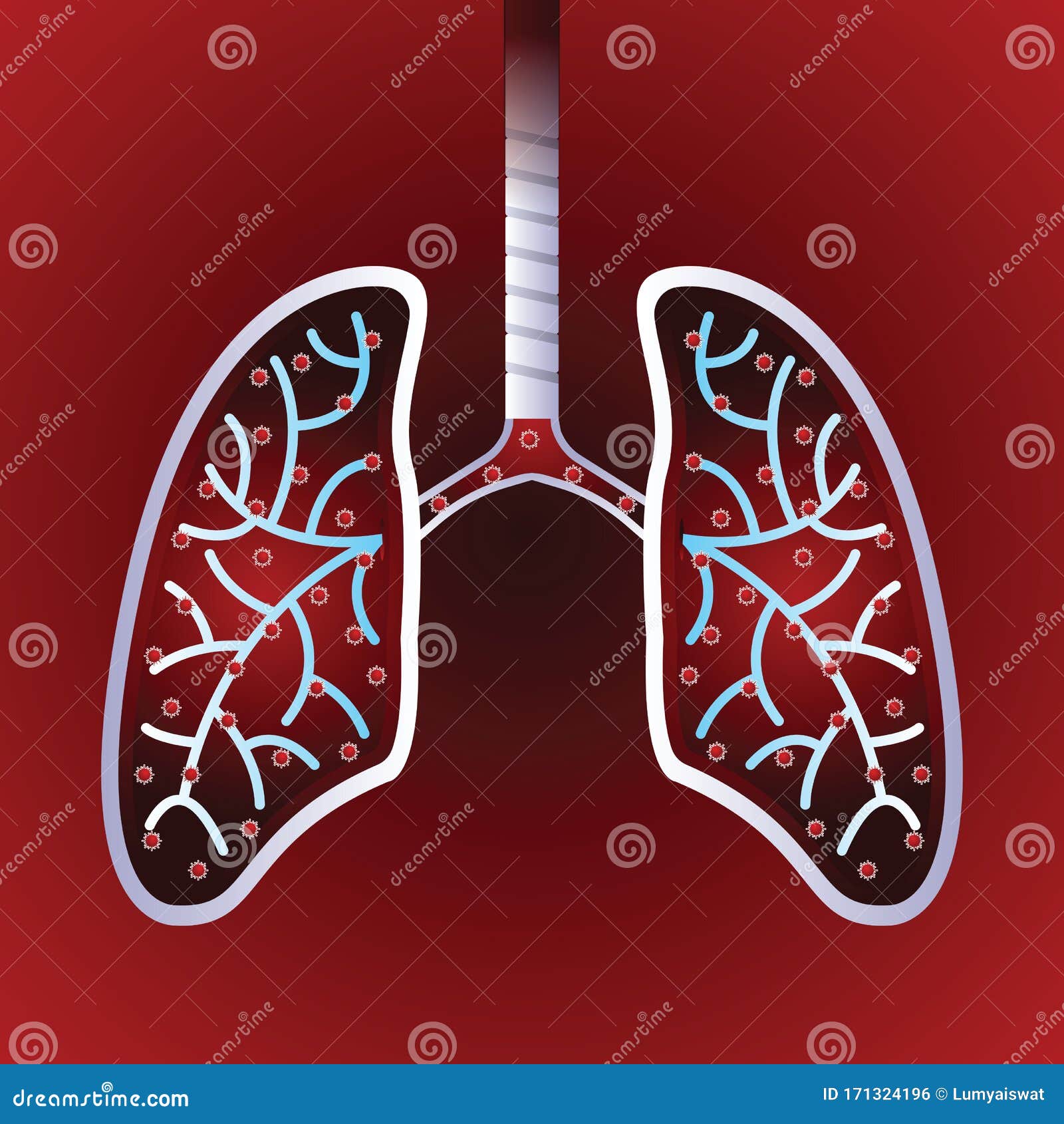 Virus And Bacteria Infected The Human Lungs Stock Vector Illustration