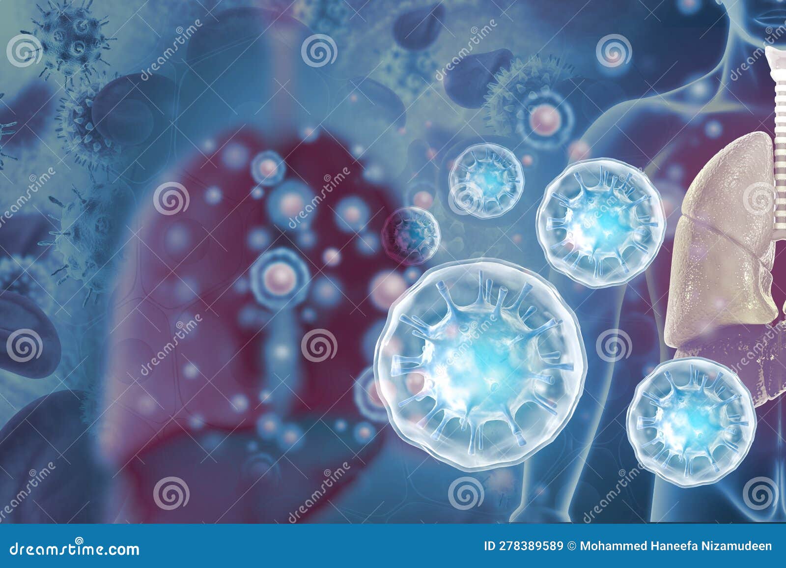 Virus And Bacteria Infected The Human Lungs Lung Disease Stock