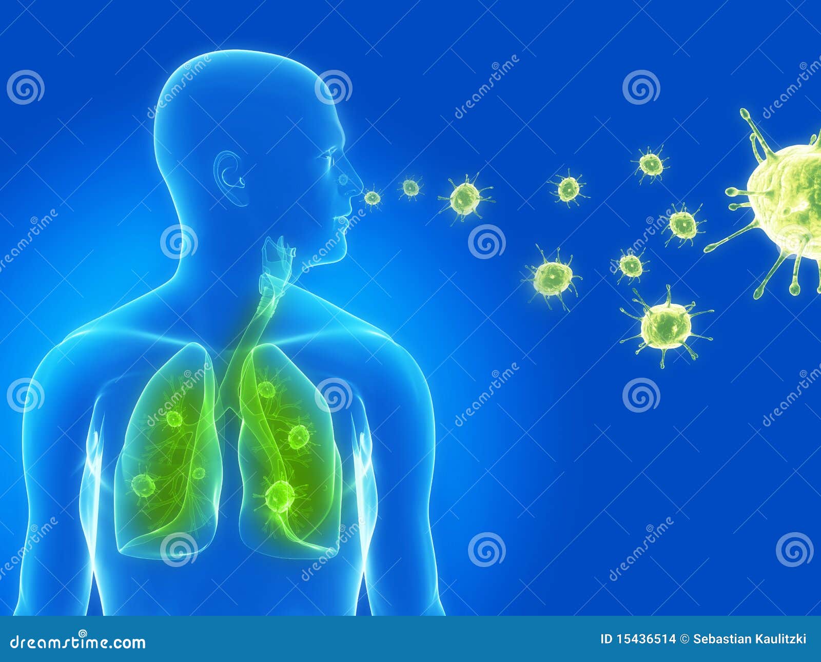 Virus infection stock illustration. Illustration of organs - 15436514