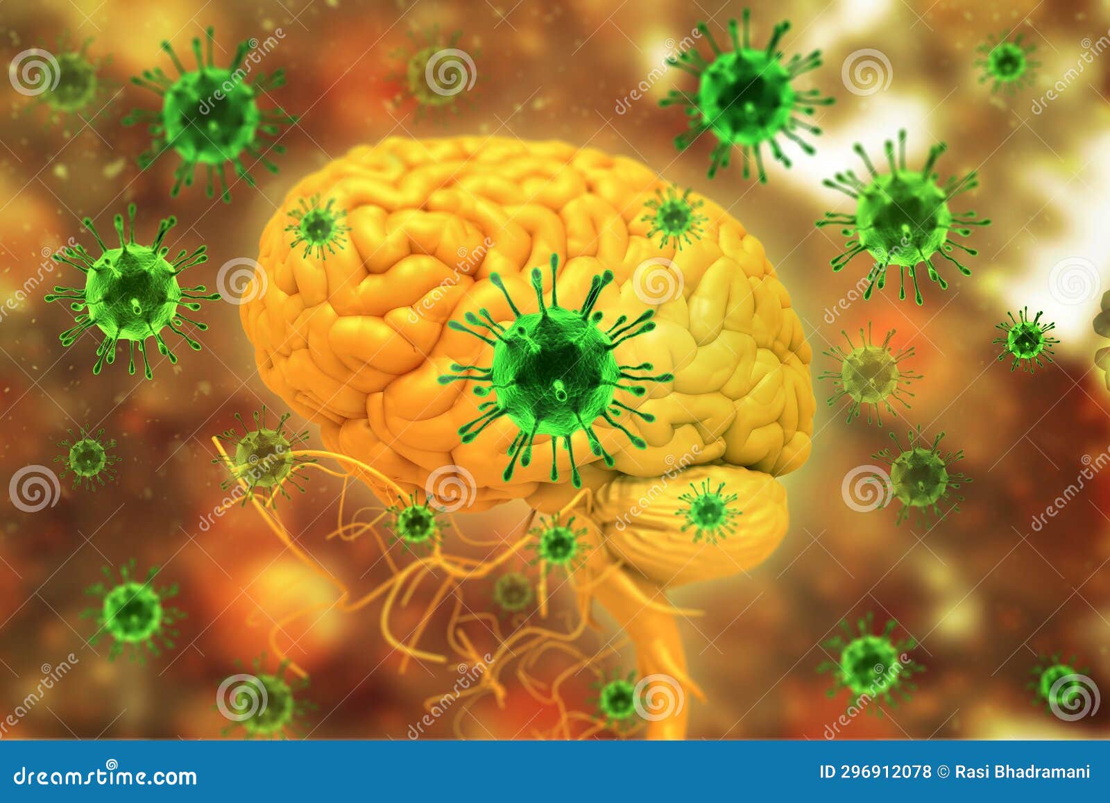 Virus infection on brain stock illustration. Illustration of chronic ...
