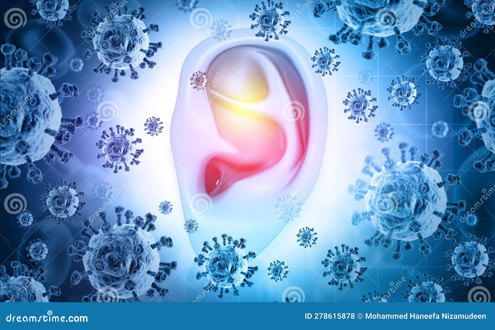 Virus Infection in the Human Ear Stock Illustration - Illustration of ...