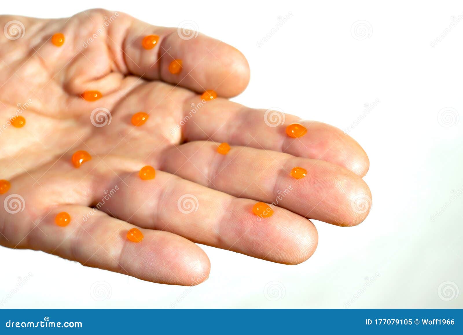 The Virus May Be on Hand. Visual Warning. Danger of Infection ...