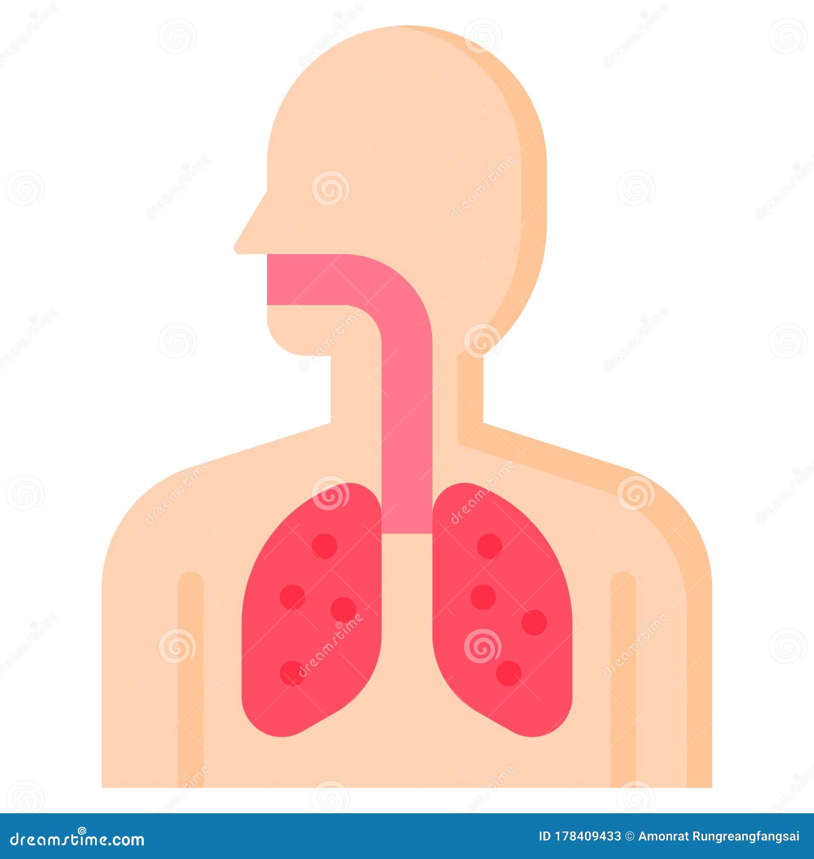 Pneumonia Vector Illustration. Labeled Diagram With Causes And Symptoms ...