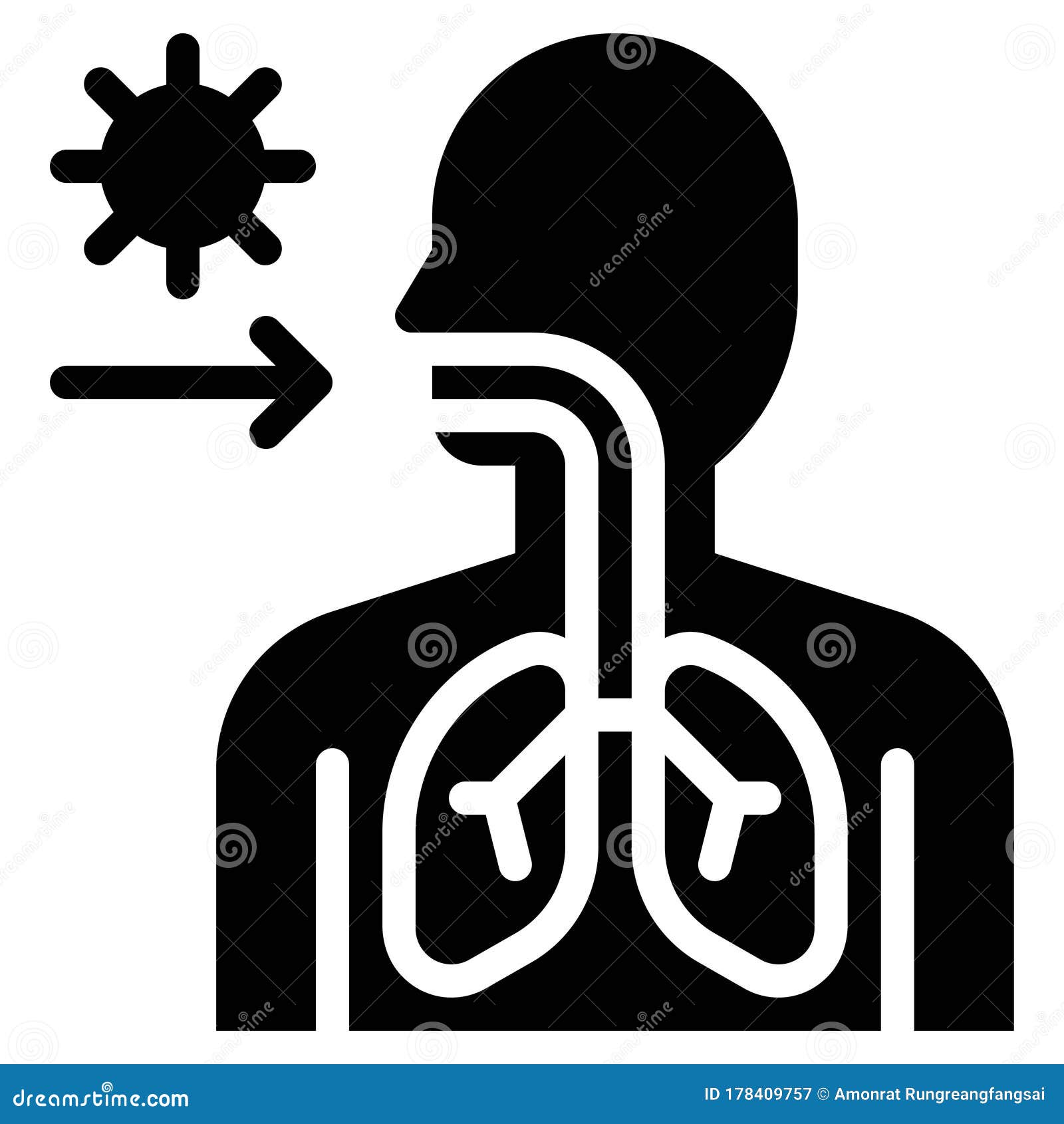 Pneumonia Vector Illustration. Labeled Diagram With Causes And Symptoms ...