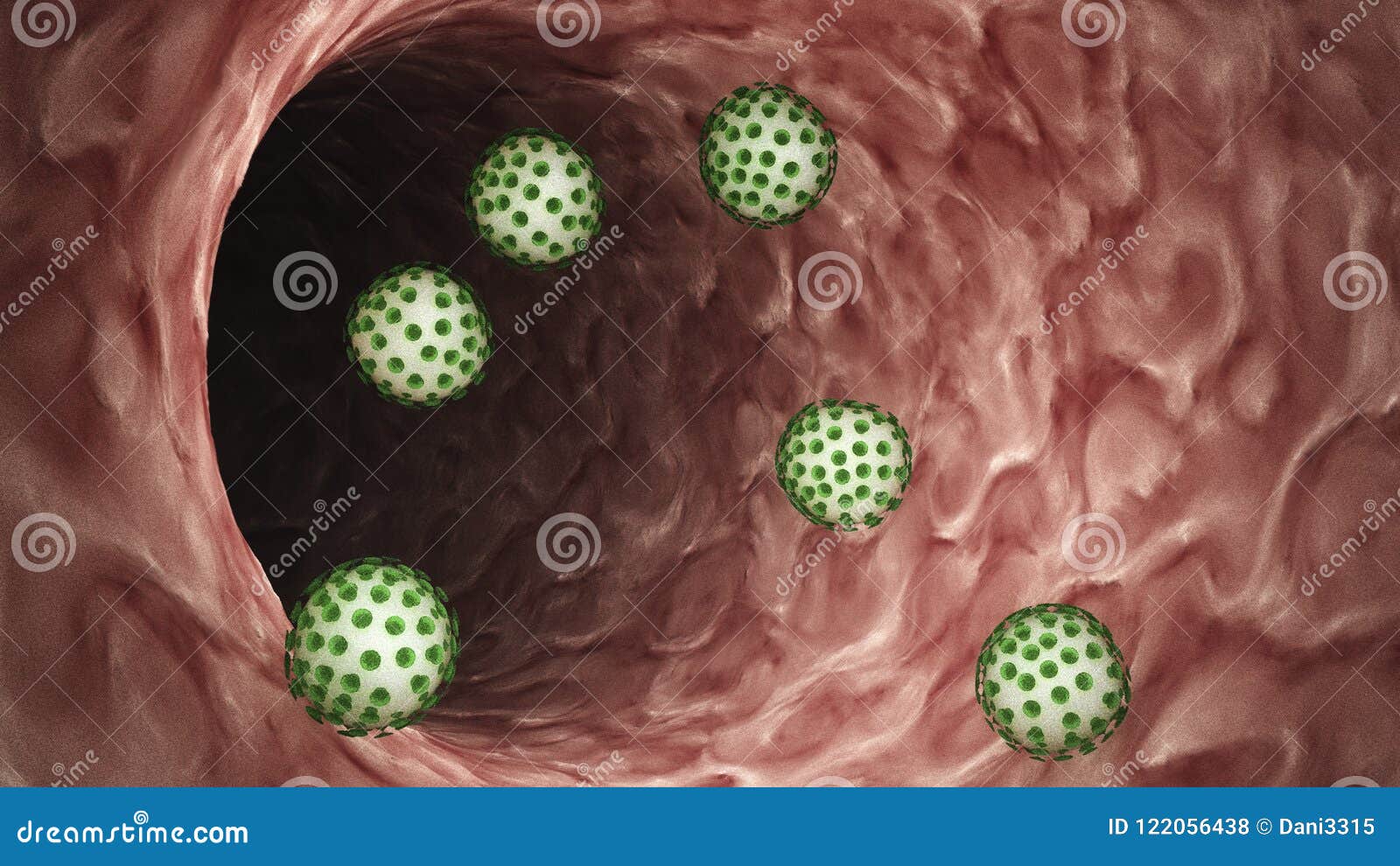 Virus Spread Inside the Body. Autoimmune Disease, Infection and Stock ...