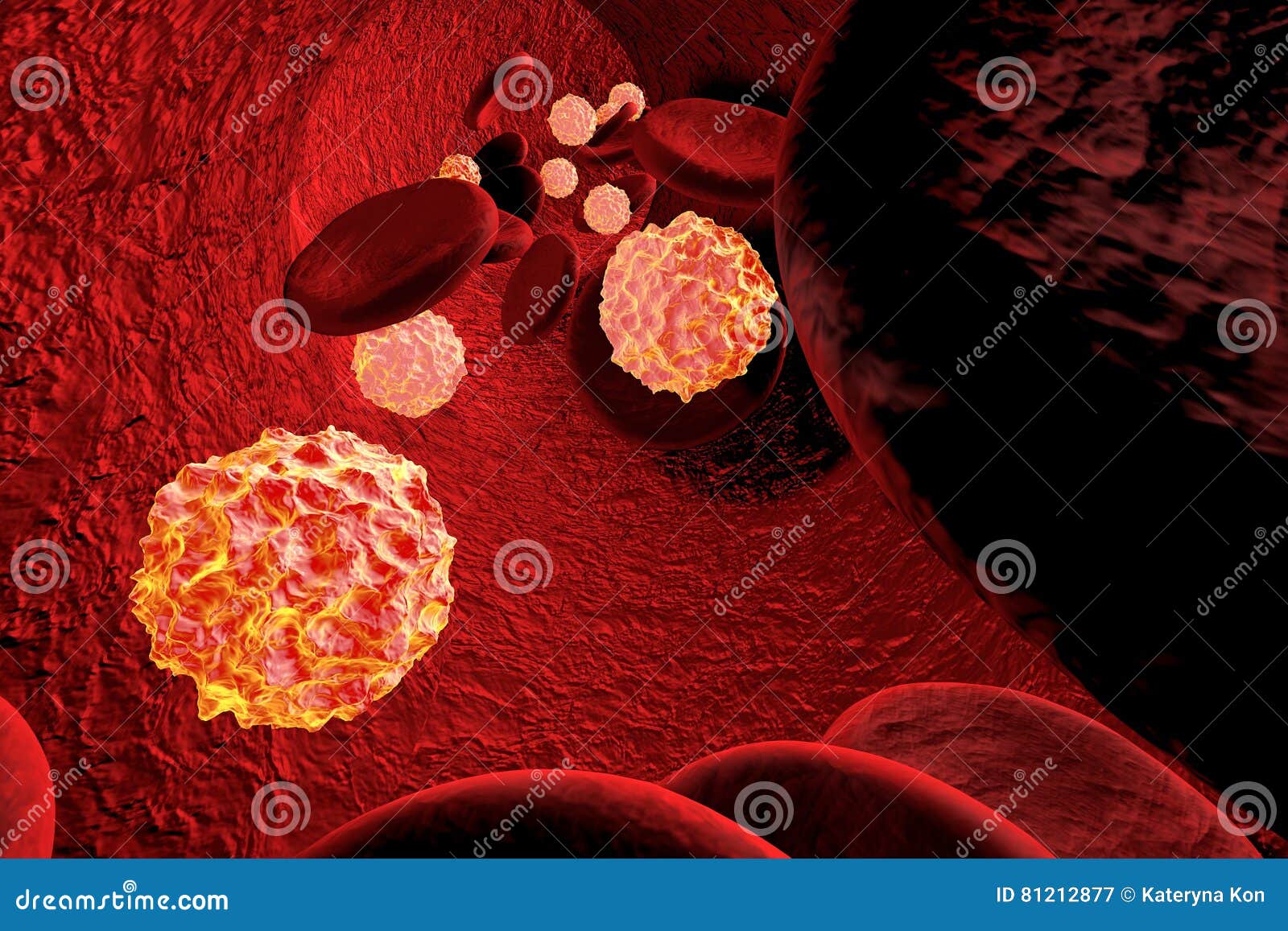 Viruses in Blood. Generalized Viral Infection Stock Illustration ...