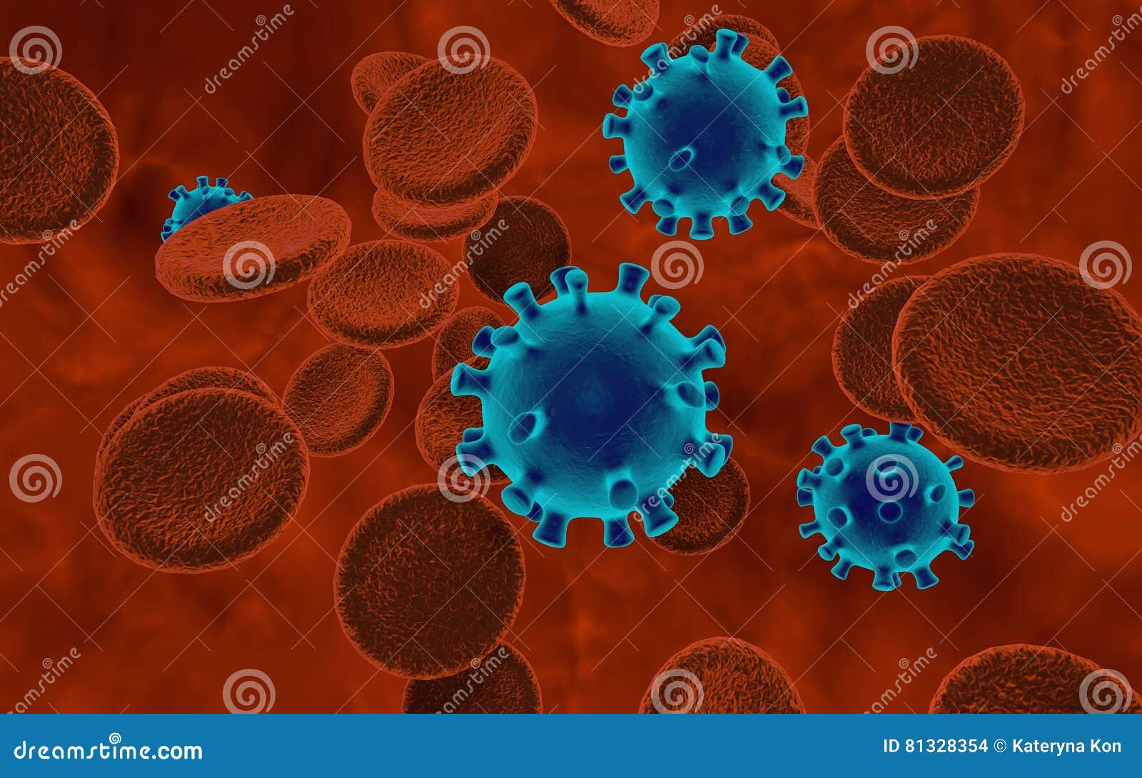 Viruses in Blood, Systemic Infection Stock Illustration - Illustration ...
