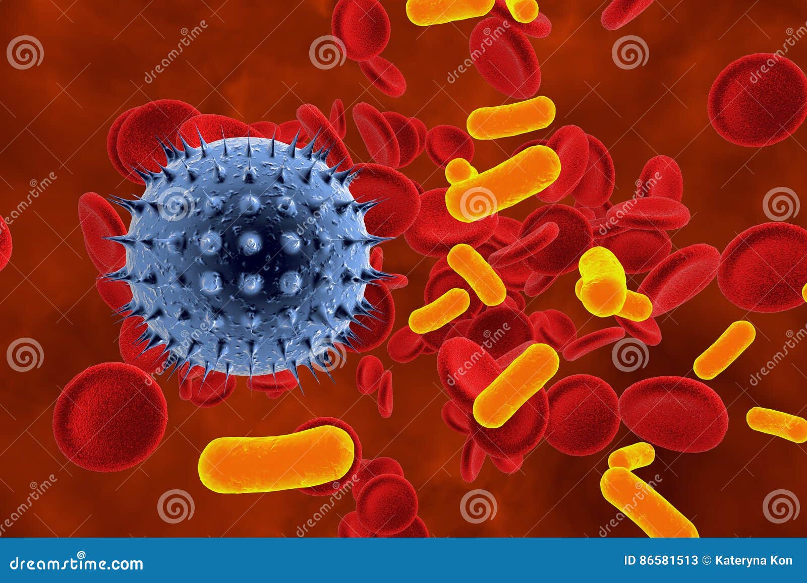 Viruses in Blood, Systemic Infection Stock Illustration - Illustration ...